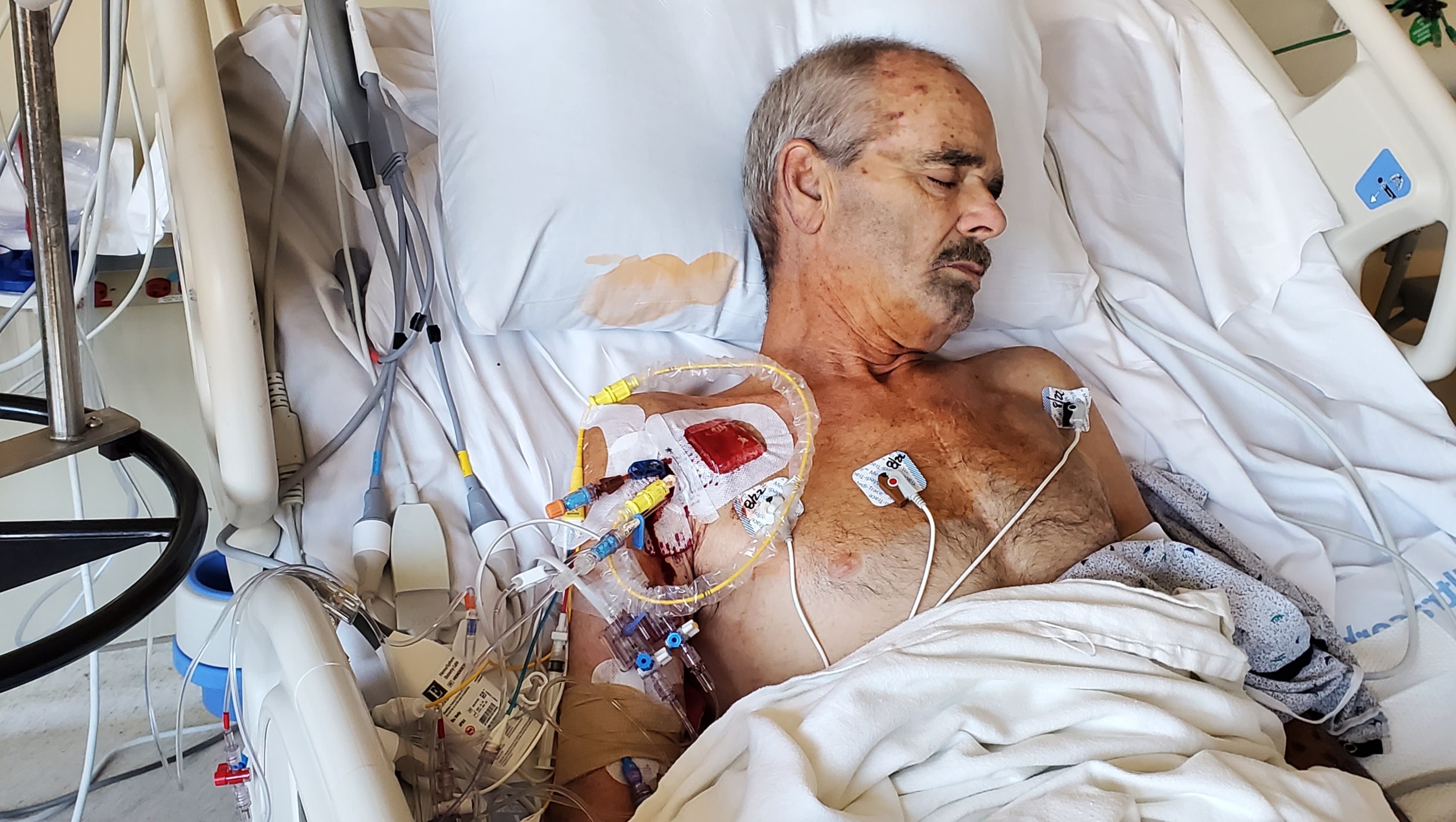 Fundraiser by Janelle Peters : Please Help Michael Settle's Fight ...