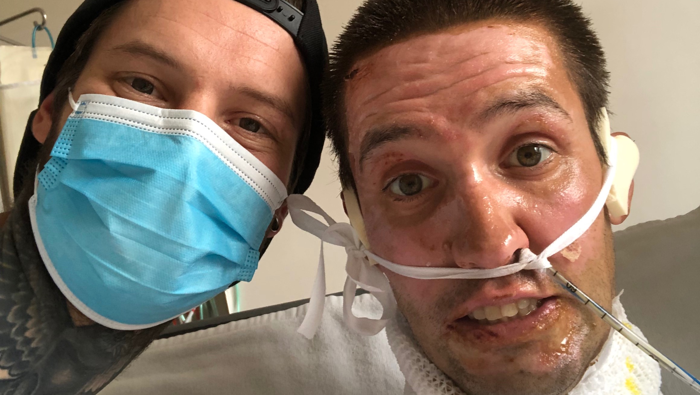 Fundraiser for Ryan Birse by Harrison Birse : Birsey’s recovery fund