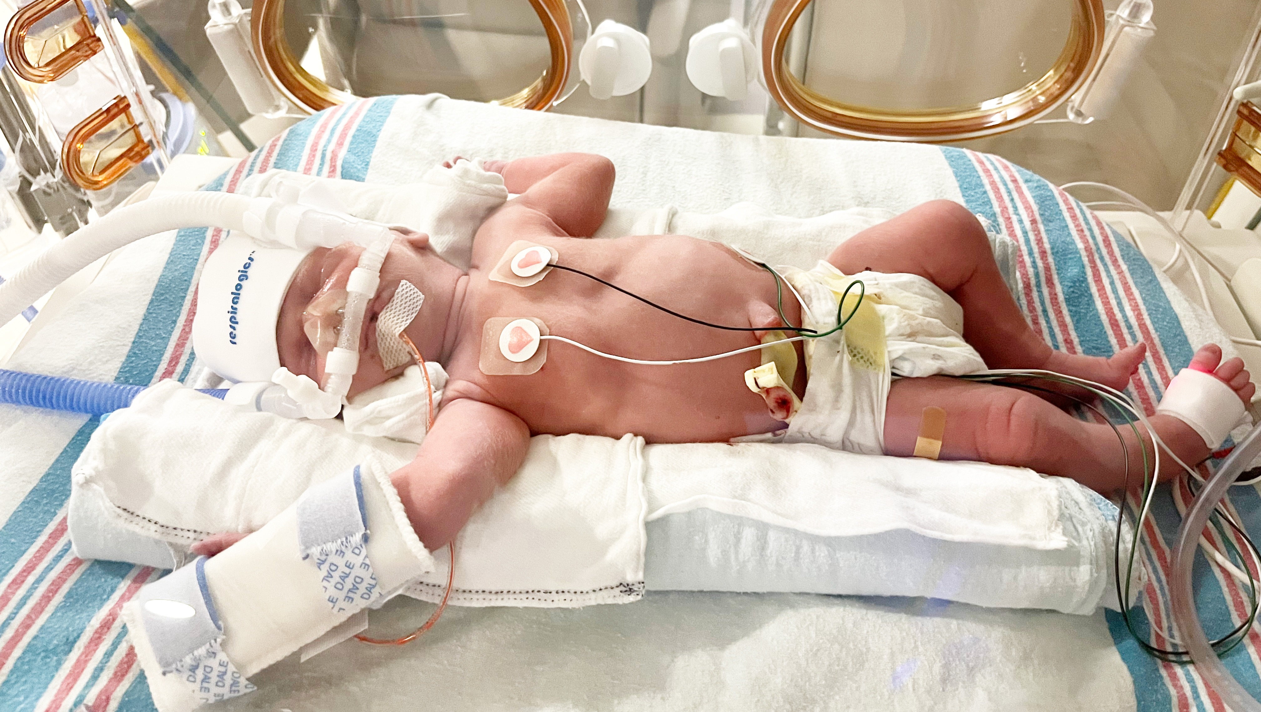 Fundraiser for Marcy Miller by Alese Russell Hopkins : Help Baby Brody ...