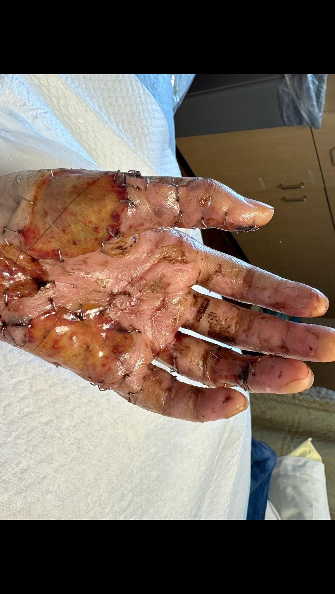 Fundraiser for kearra young by Jason Roeser : Support Kearra's Recovery ...