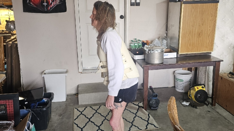 Fundraiser by Cheryl Vasquez : Help Cheryl save her Spine...