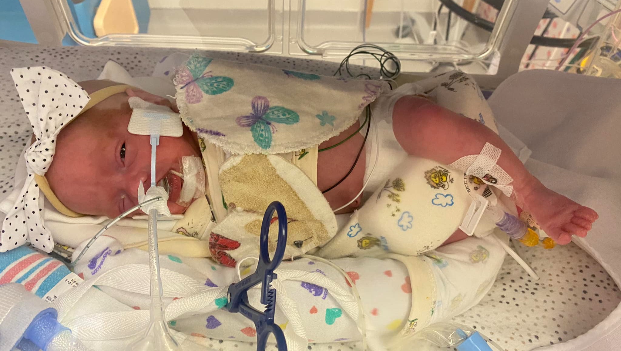 Fundraiser for Veronica Dunlap by Kris Wilson : Help Elowyn fight for ...