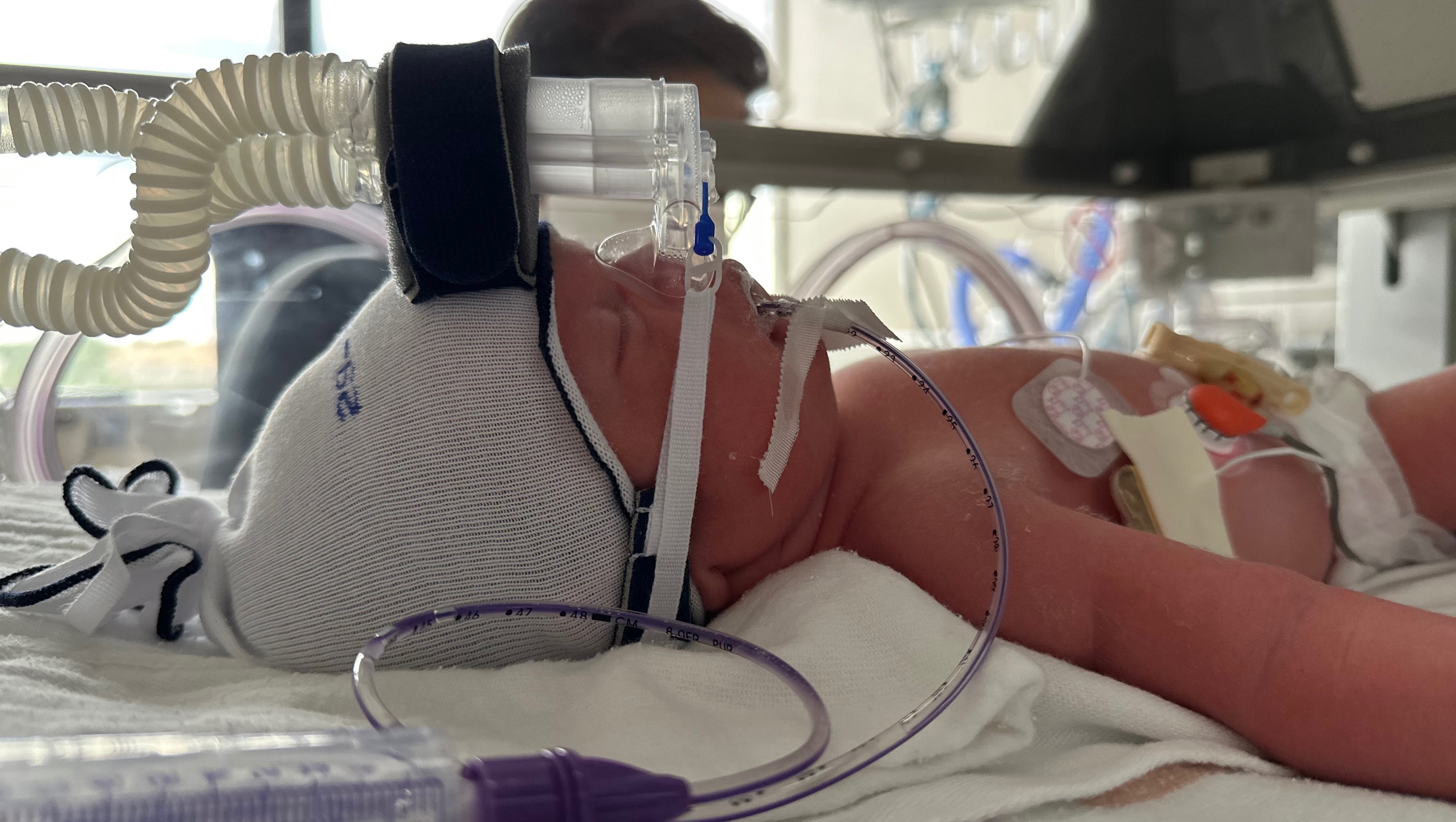 Fundraiser for Katie Romano by Jessika Howald : Support for Monear ...