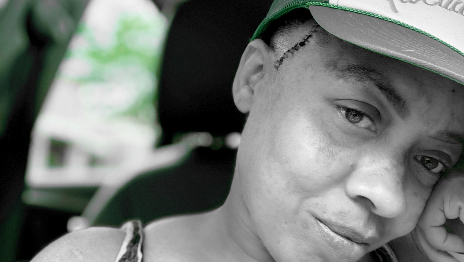 Fundraiser by Betty Green : Support Nyssa's Brain Surgery Recovery