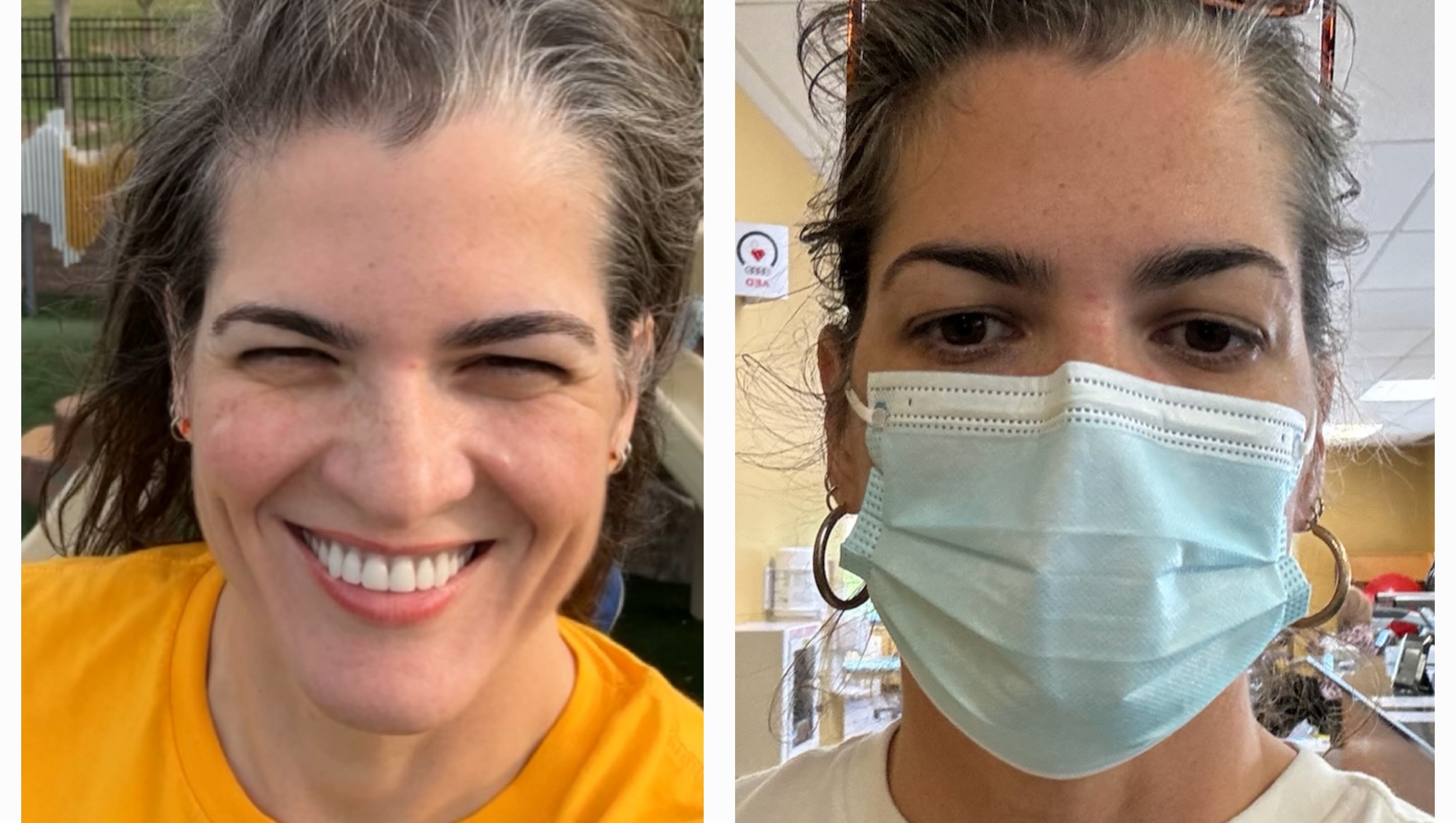 Fundraiser by Bridget O'Leary : Help Arkay Secure Life-Changing Jaw Surgery