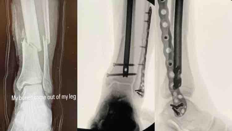 Fundraiser for Taryn Zinszer by Lawrence Simms : Rally for Taz: Aid His ...