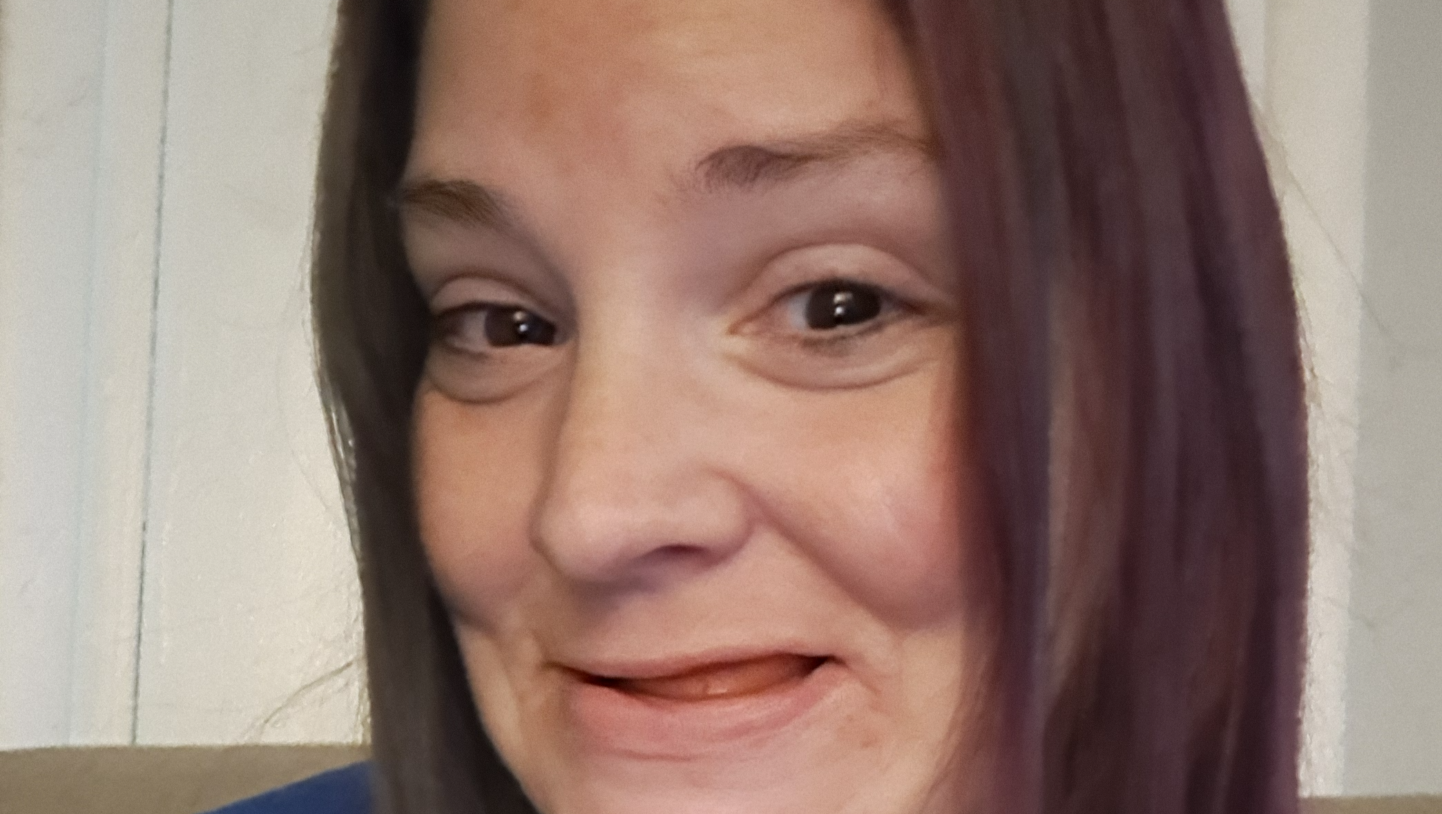 Fundraiser by Stephanie Eschrich : Help Stephanie Smile Again
