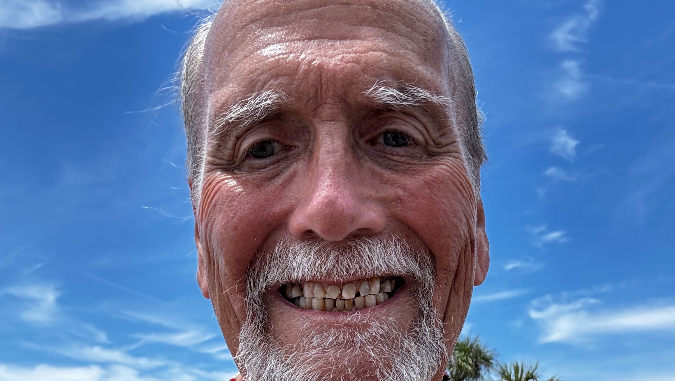 Fundraiser by Robert C James : Support for Brain Injury Survivor's Recovery