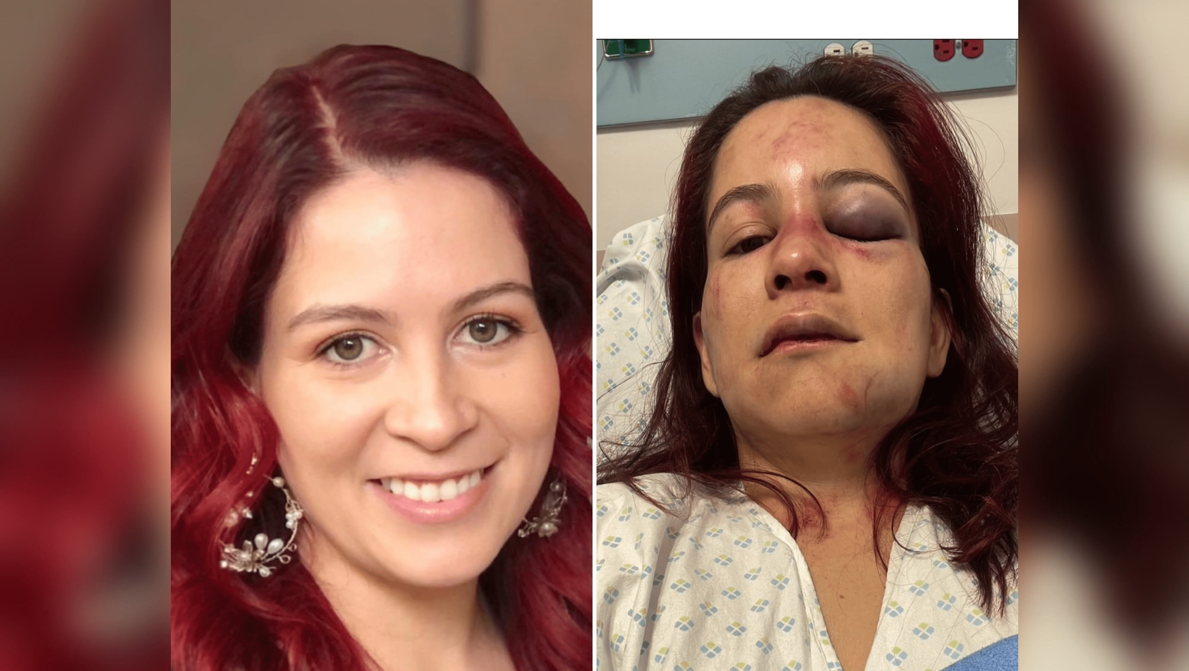 Fundraiser by Maria Arango : Help Jessy Heal and Secure Justice