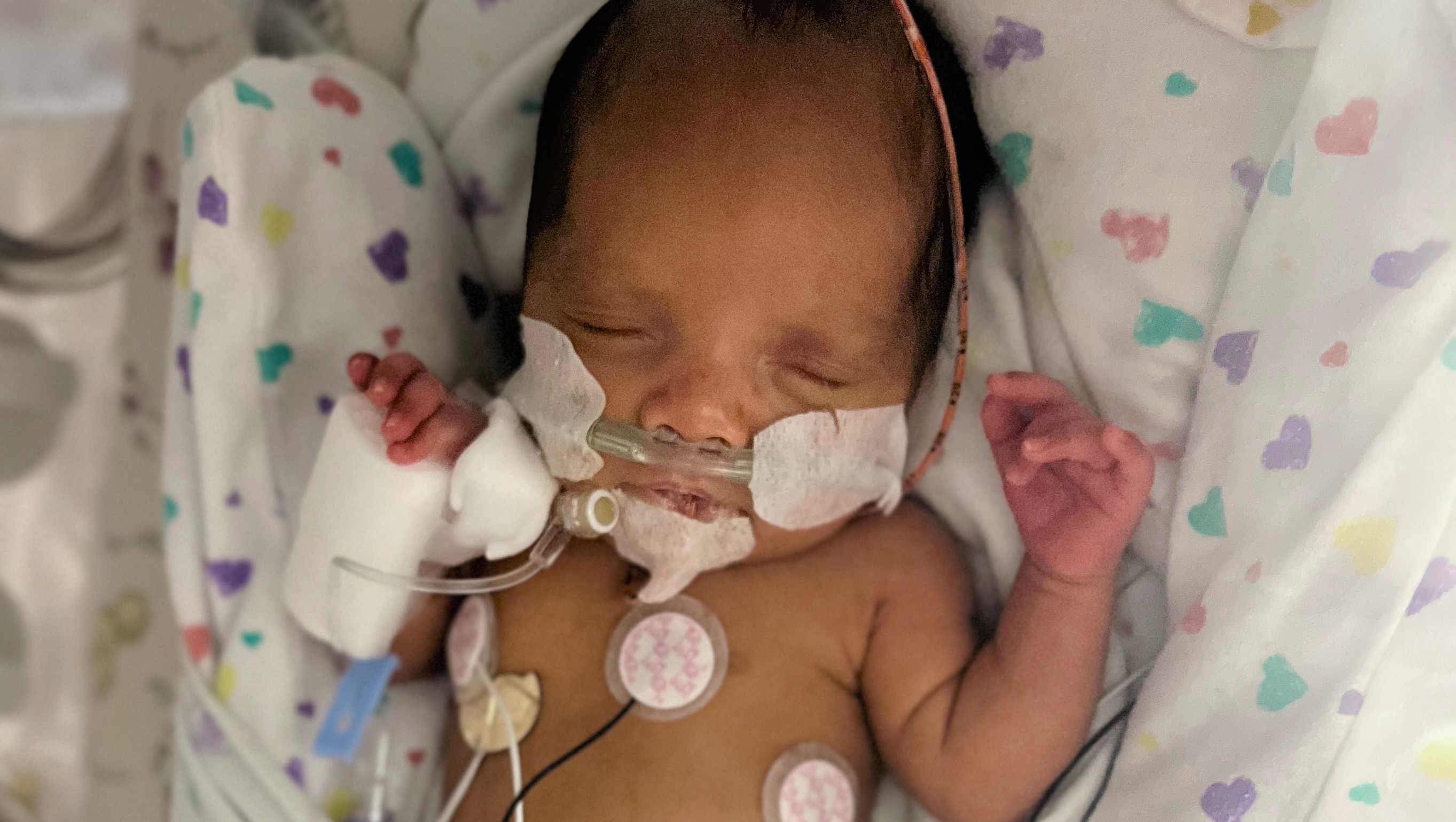 Fundraiser by Renee Davis : Renee Dugas-Davis' Support Itzel's Recovery ...