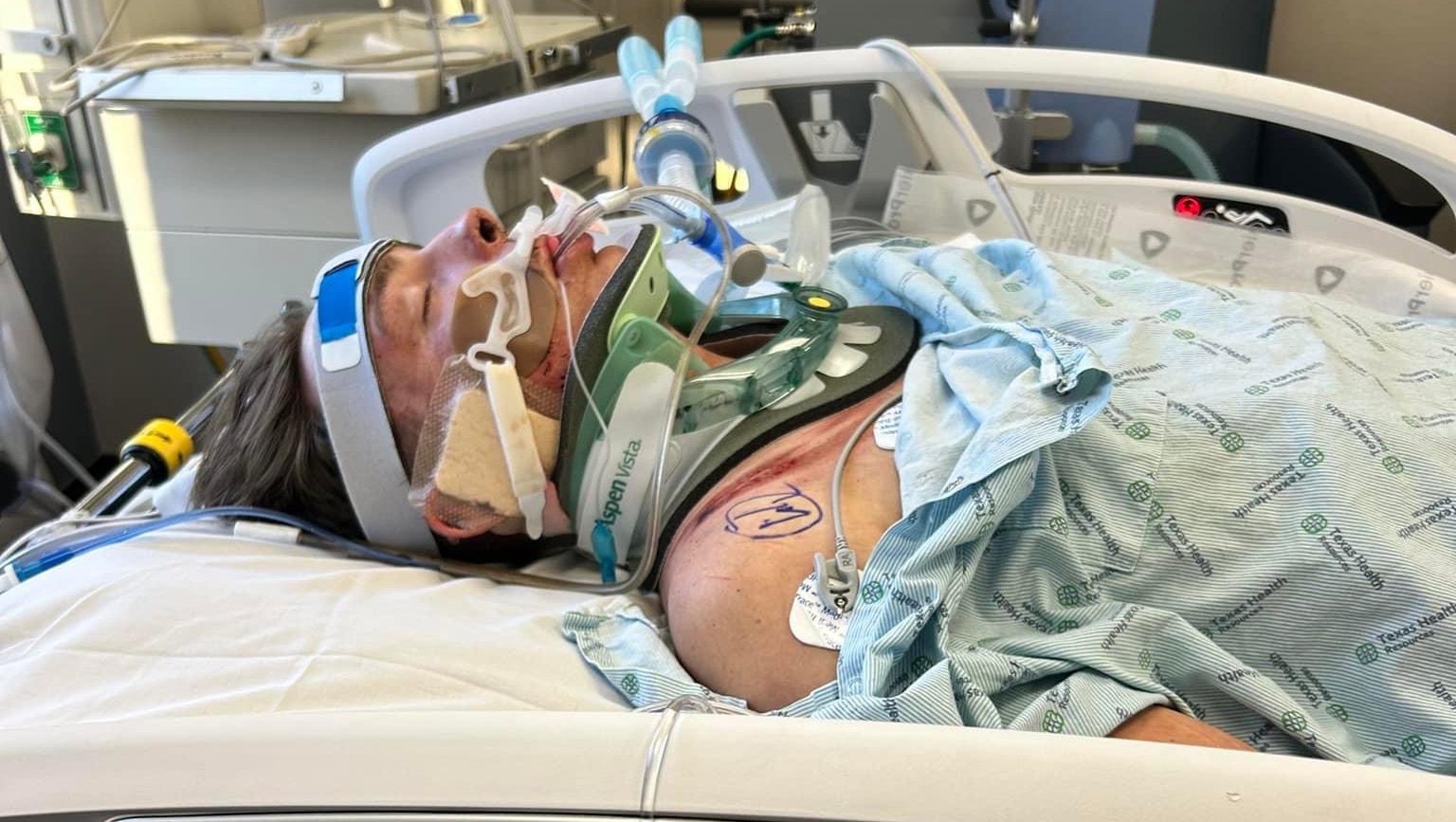Fundraiser by Samantha Kerr : Help Aidan Kelly Shaffer Heal After ...