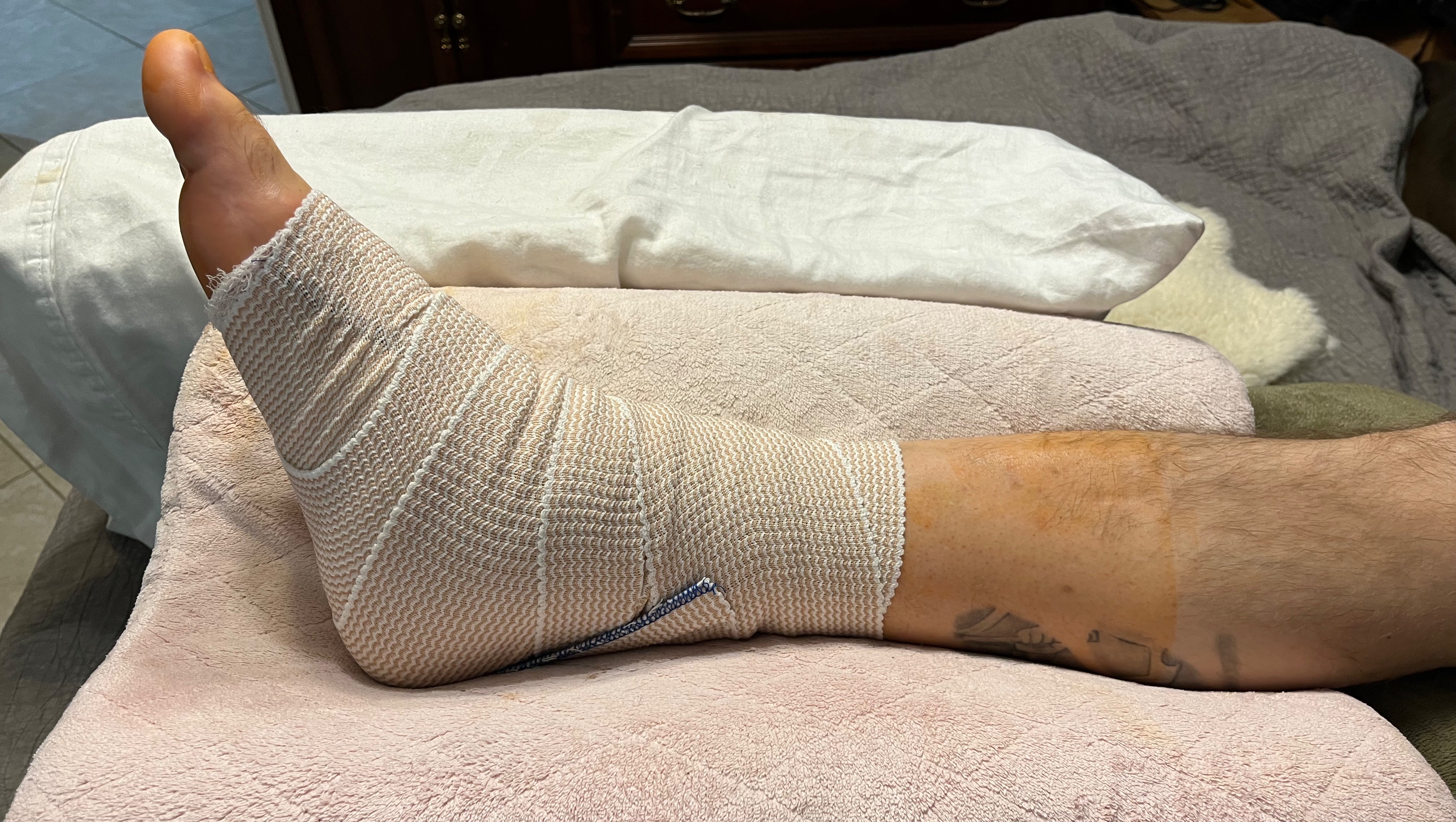Fundraiser by Joanne Hickox : Help Chad Recover and Thrive After Ankle ...