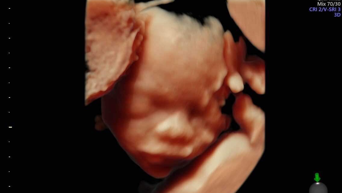 Fundraiser for Jessica Rosin by Saige Blanchard : Help Jessie and ...