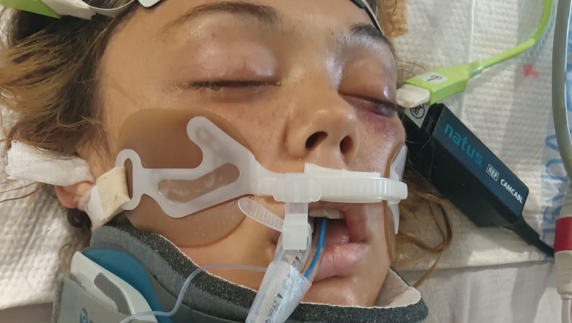 Fundraiser by Laylay Hinton : Support Angelina's Road to Recovery