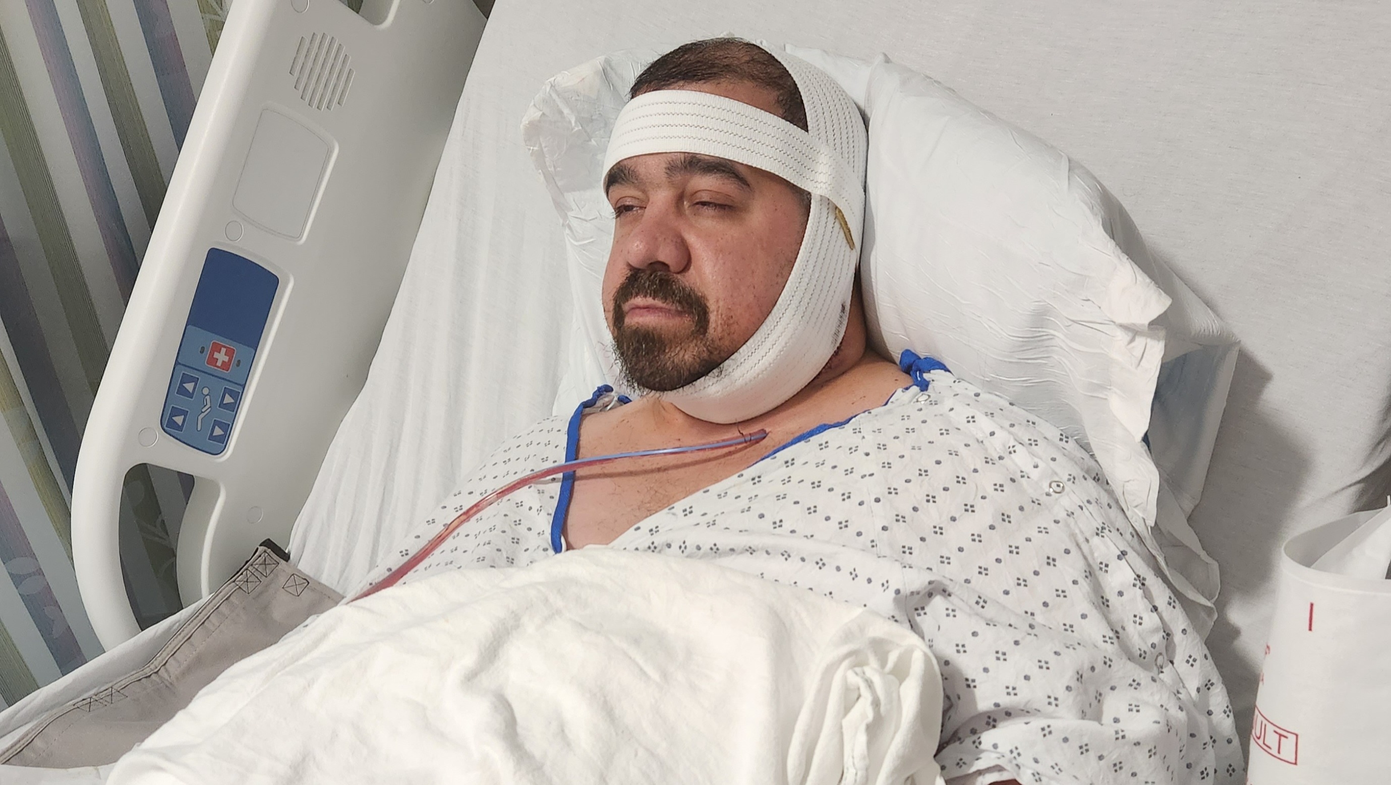 Fundraiser by edwin falcon : Support Edwin Falcon's Battle with Tongue ...