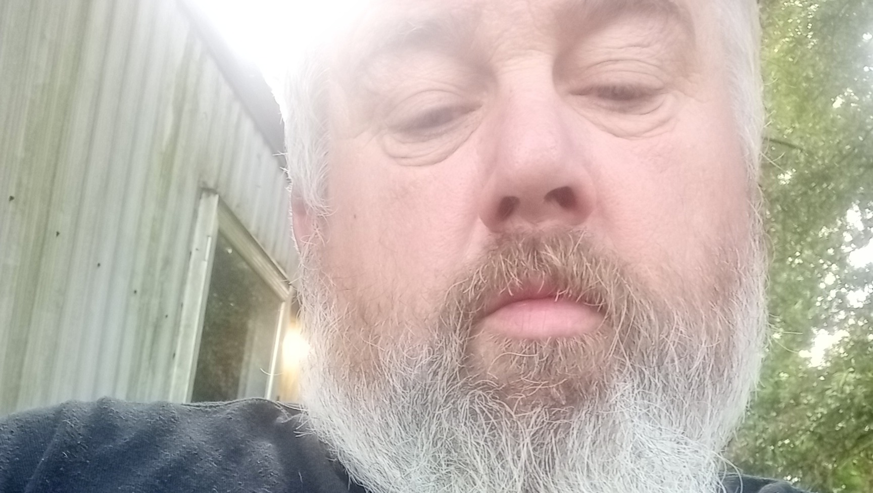 Fundraiser by Jeremy Bible : Support Needed for Leg Prosthetic Expenses