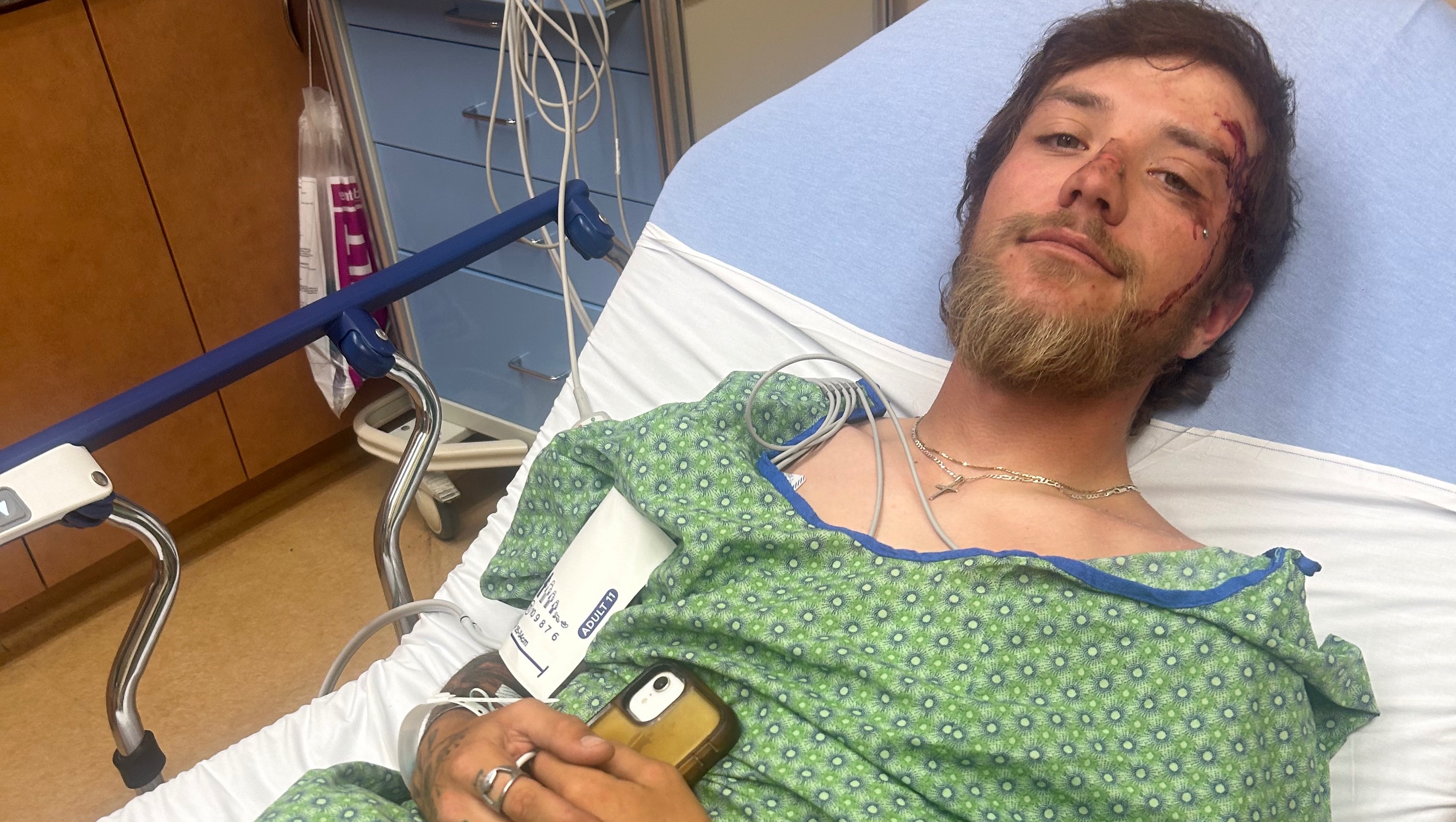 Fundraiser by Noah Muir : Donate to Aid Recovery from Severe Motorcycle ...