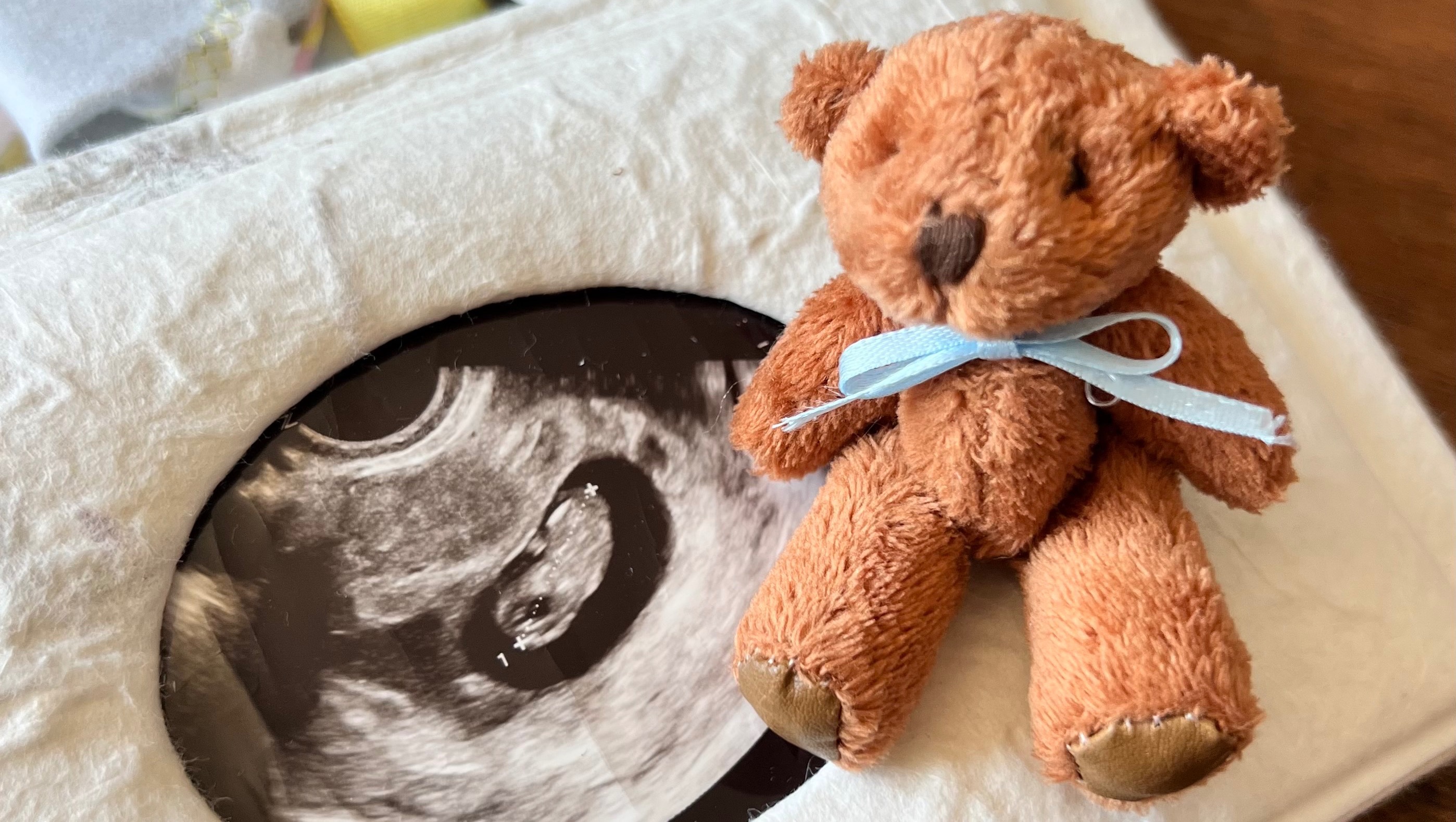 Fundraiser by Ariel Goldman : Asher's Memorial Garden Butterfly Bench