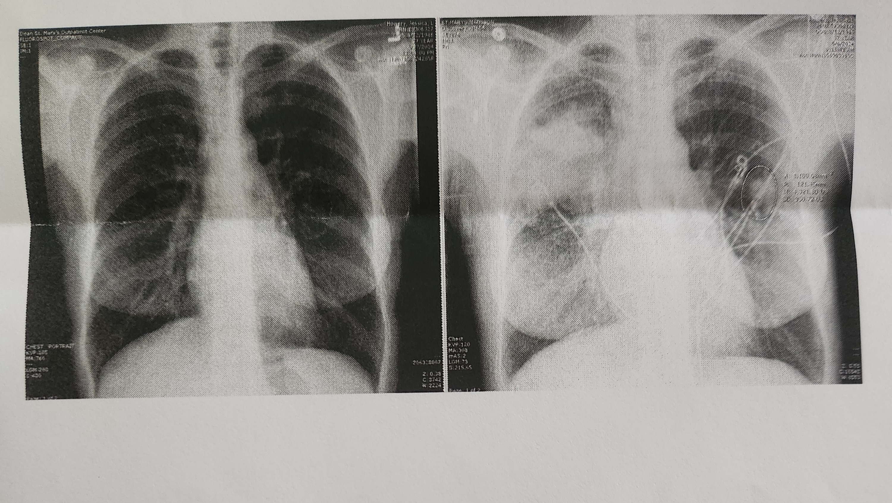 Fundraiser by Jessica Howery : Unsuspected Health Scare