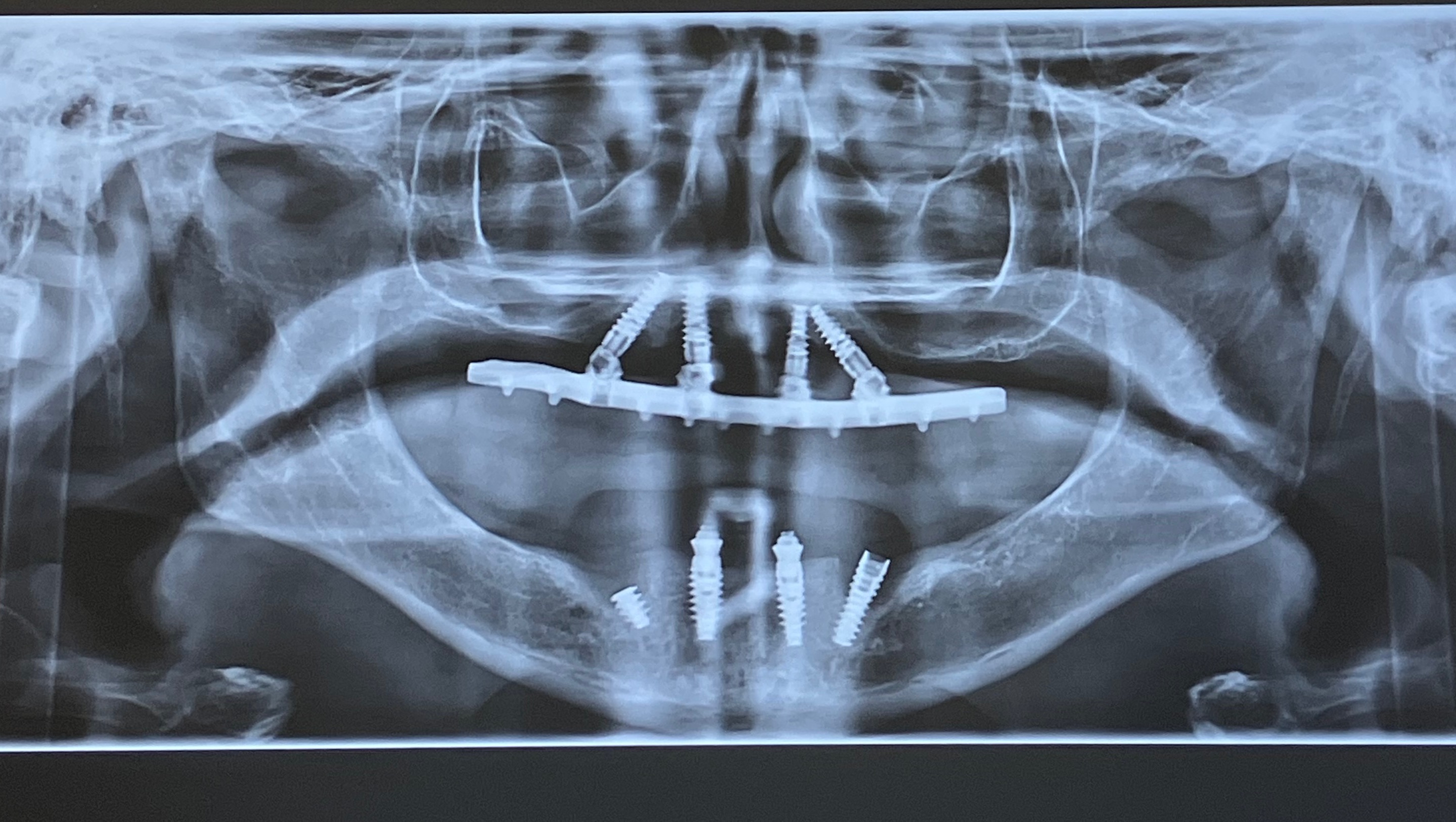 Fundraiser for Ed Rittenhouse by Charlotte OBrien : Help Ed Rittenhouse ...