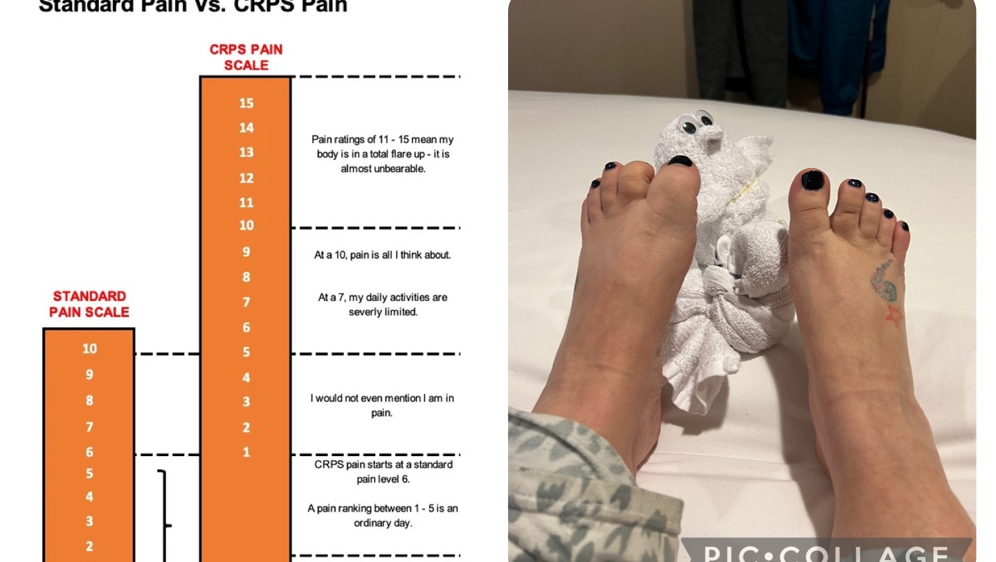 Fundraiser by Heidi Goettlich : Help Restore Life for CRPS Patient with ...