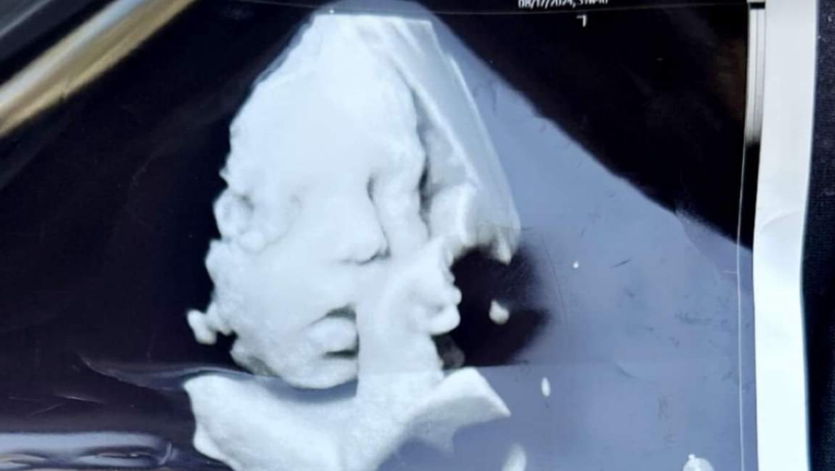 Fundraiser by Geovanni Williams : Help Lay Rylo Anthony King Williams ...