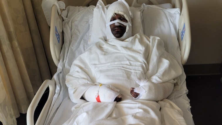 Fundraiser for Elsea Crumble by Mary Sue : Help Elsea Recover from ...