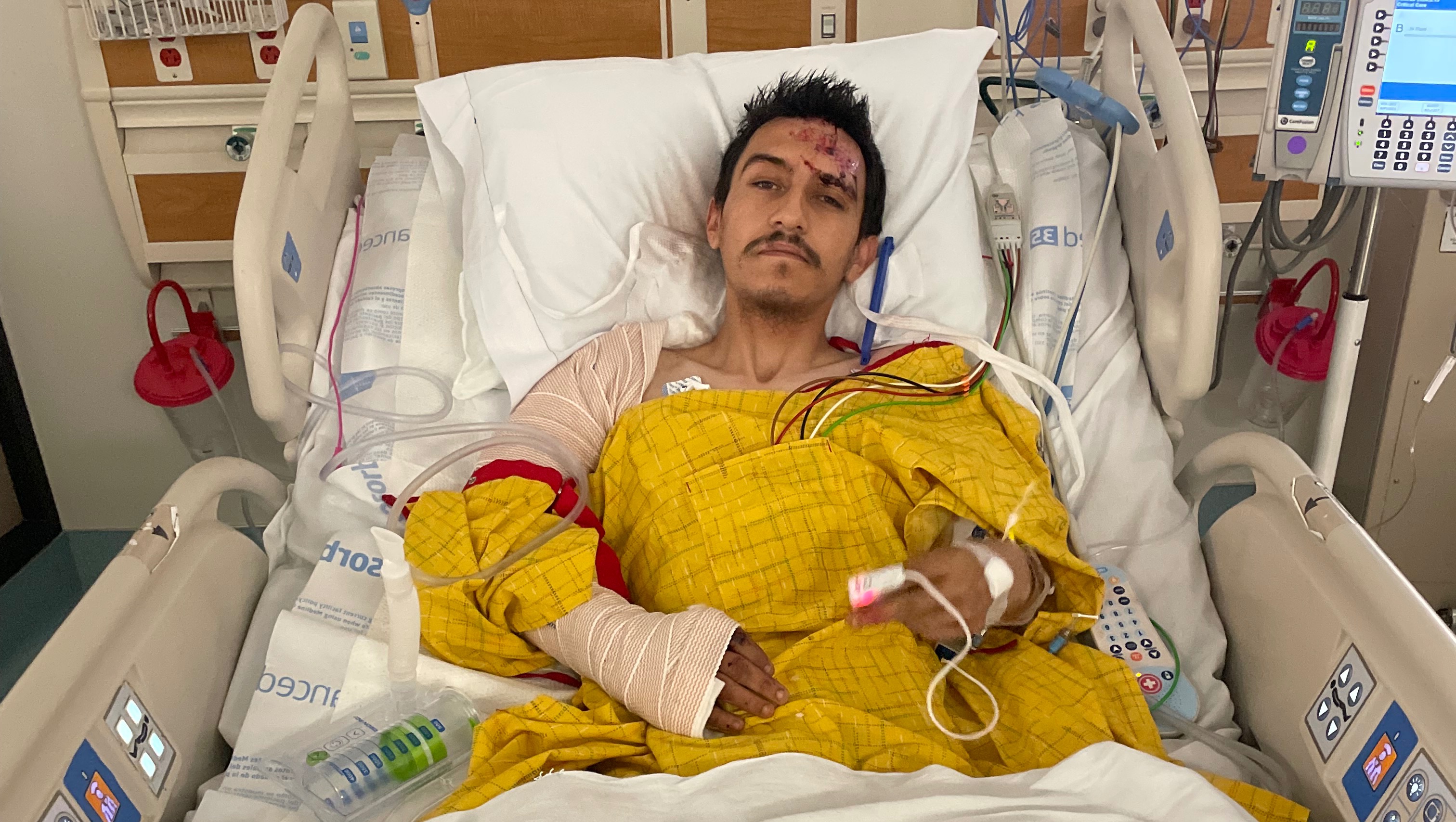 Fundraiser by Andrew Duarte : Aid Andrew Duarte's Family and Reptile ...