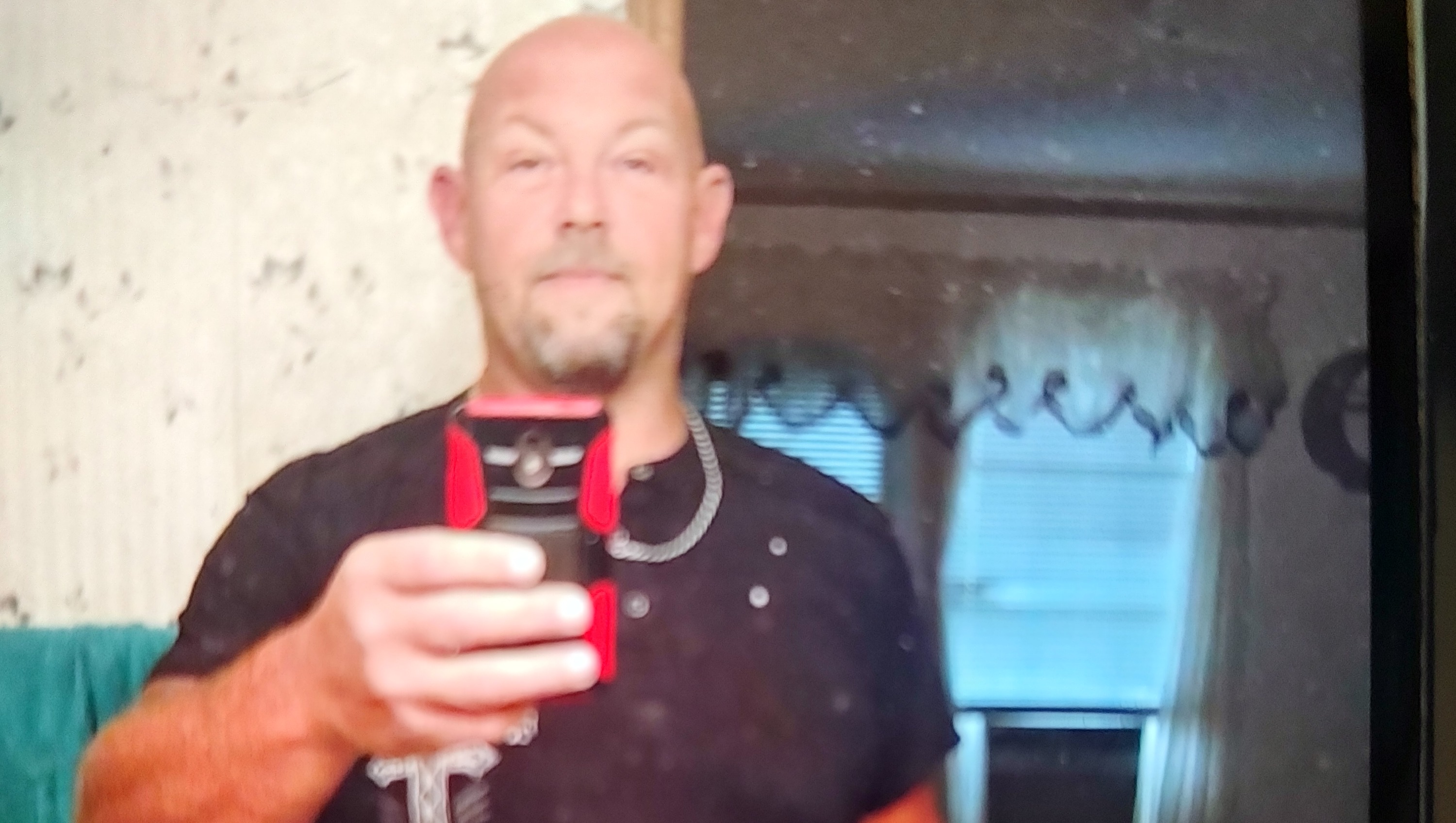 Fundraiser by James Choate : Support James's Urgent Back Surgery