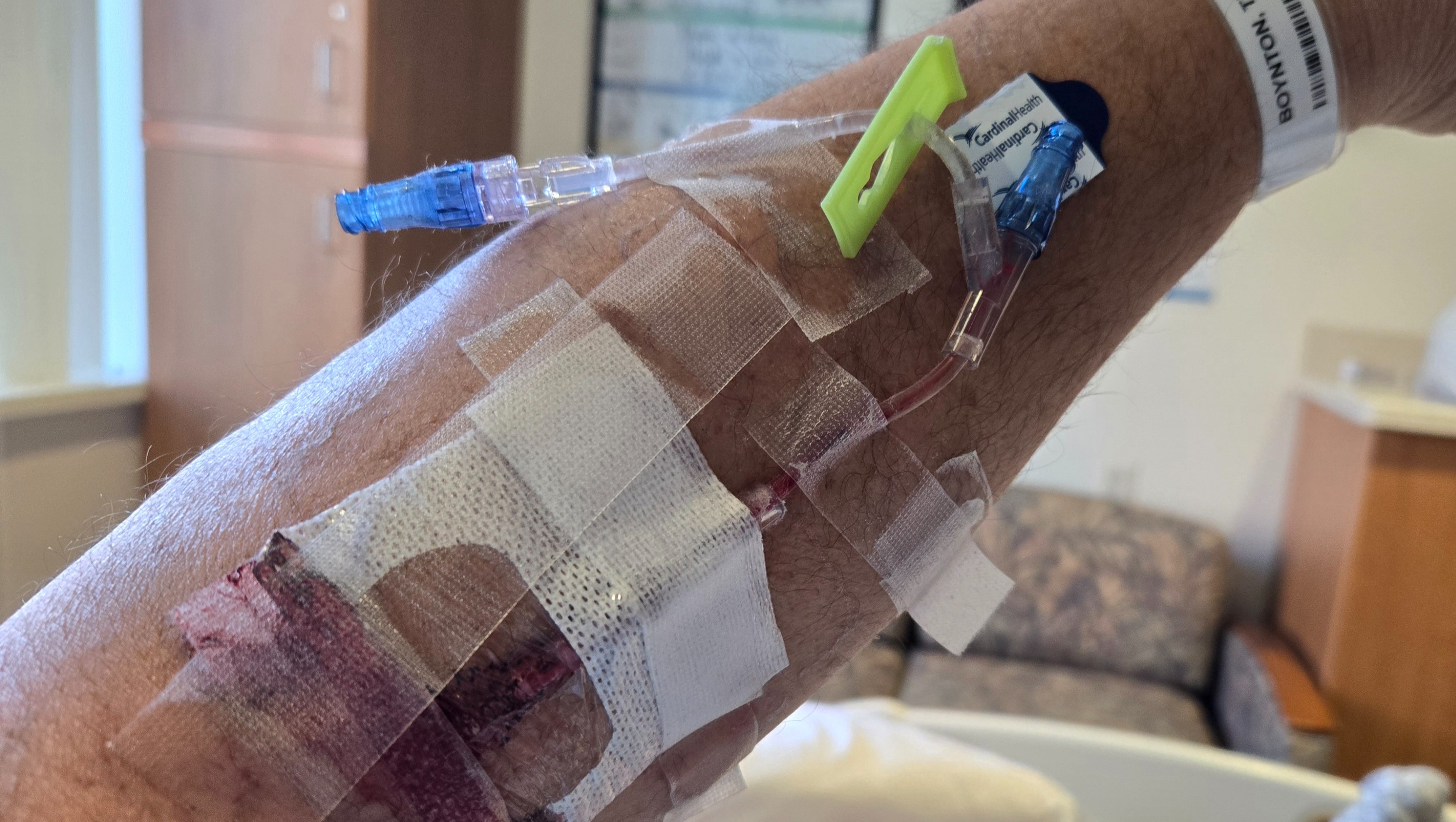 Fundraiser by Thomas Boynton : Support Tom Boynton's Triple Bypass Recovery