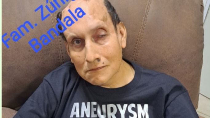 Fundraiser by Edna Veronica Bandala Hernández : Luis sobreviviente ...