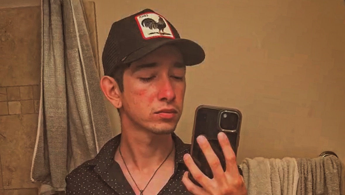 Fundraiser for Alan Ochoa by Maria Perez : Join Us in Alan's Recovery ...