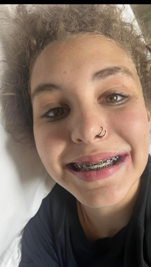 Fundraiser for Amanda Maness by Blanche Butcher : Help Macie Heal After ...