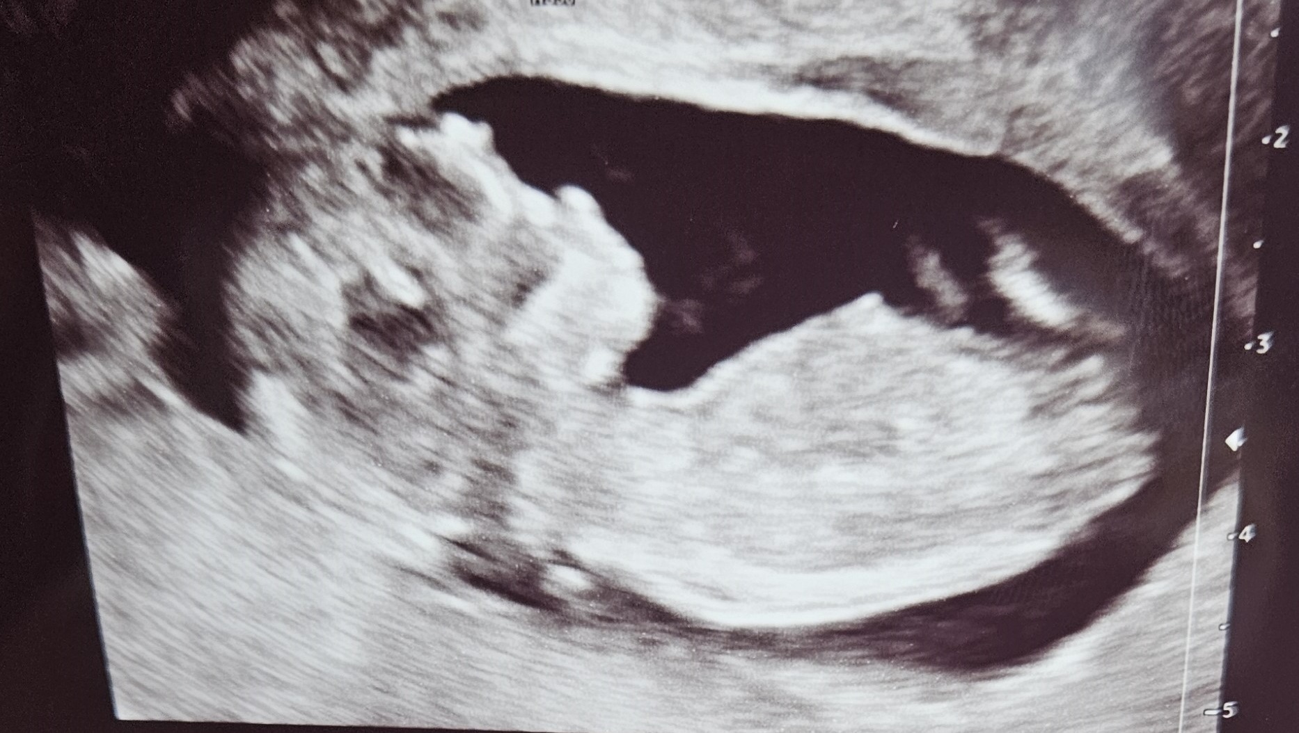 Fundraiser by Alba Lamar : Support Alba and Claude's Journey to Parenthood