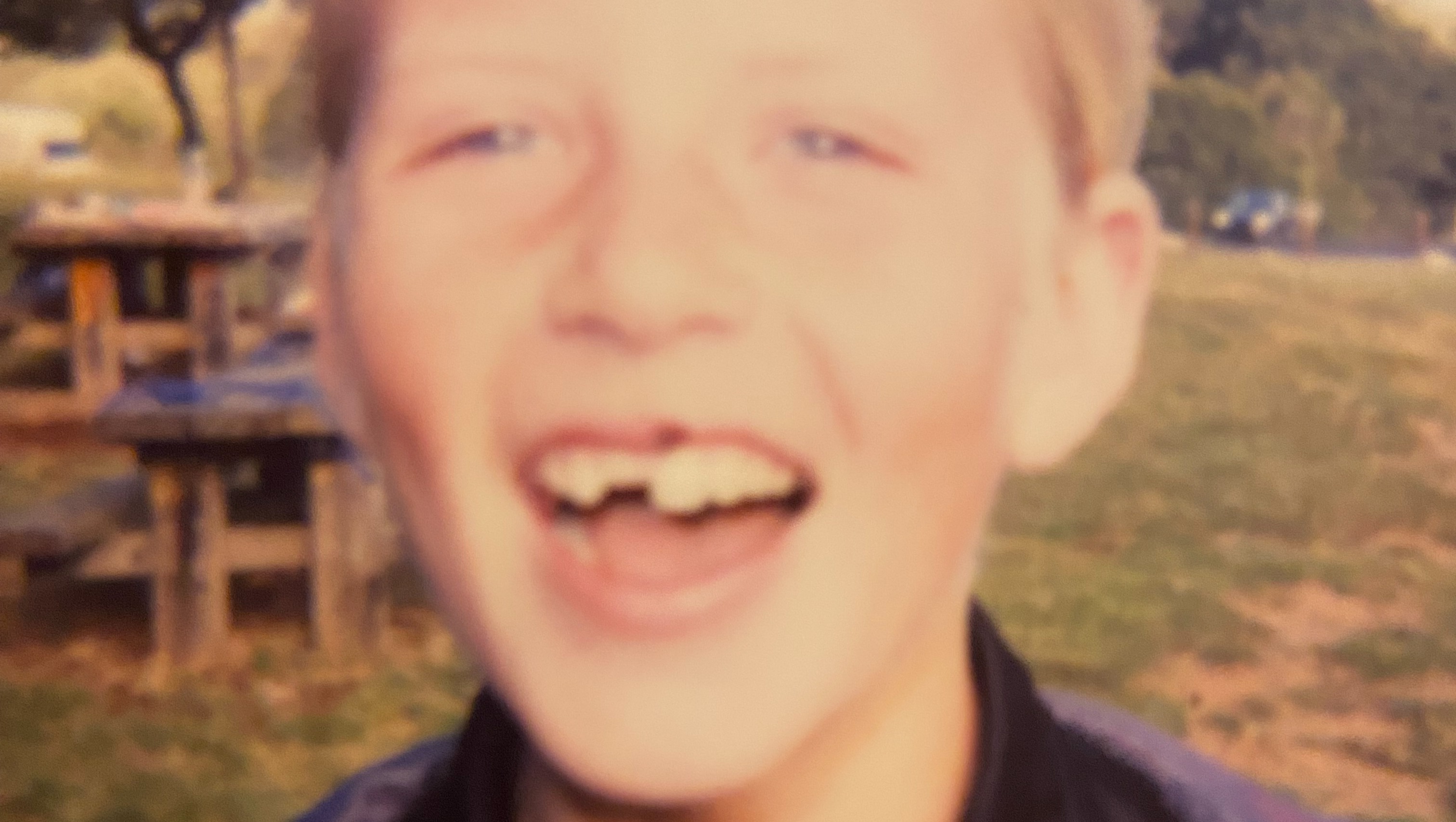 Fundraiser by Tiffany Fullmer : Save Tyler's Smile: Major Dental Care ...