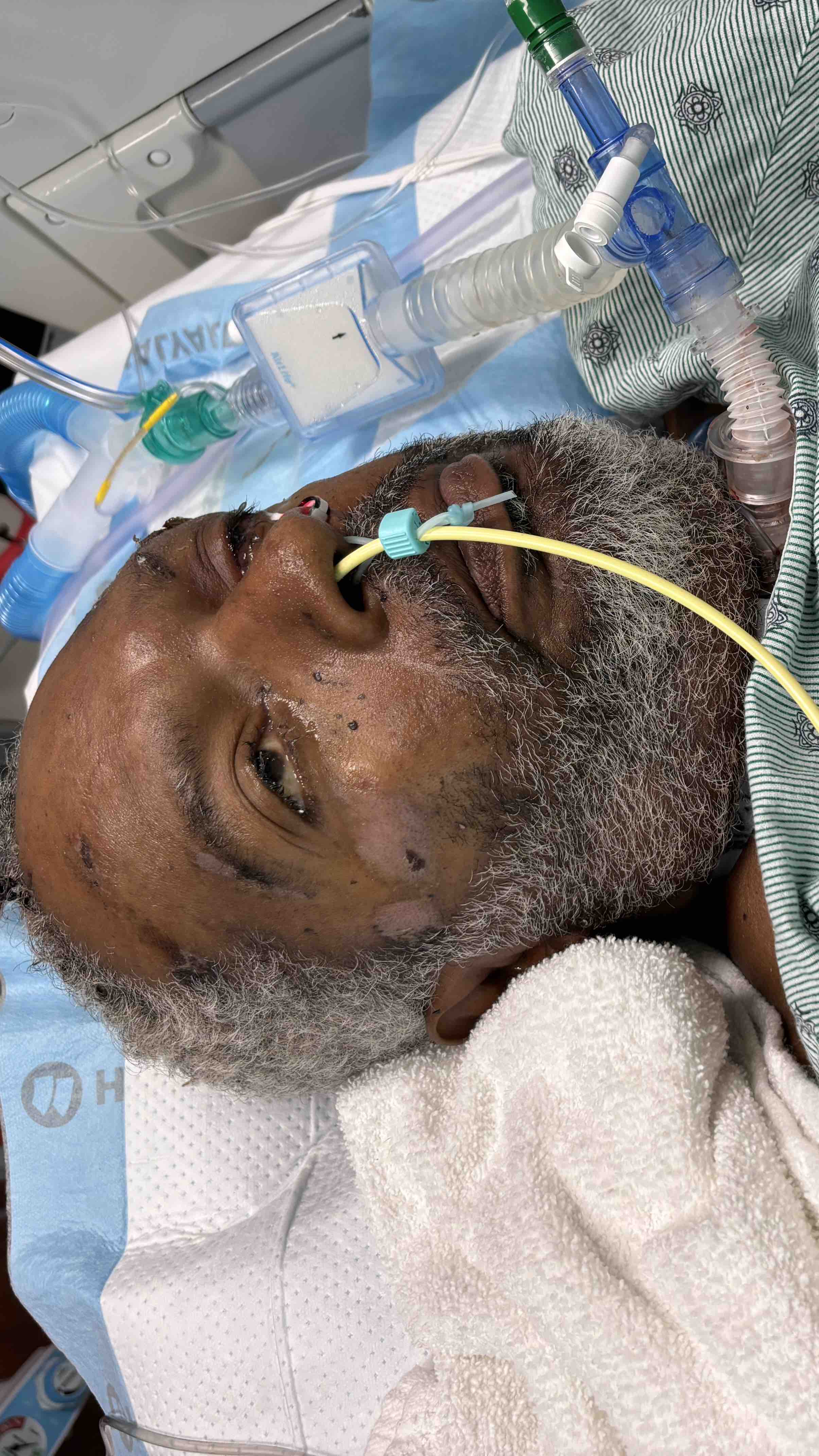 Fundraiser by Nereyda Lago : Support Lazaro Laera's Critical Recovery