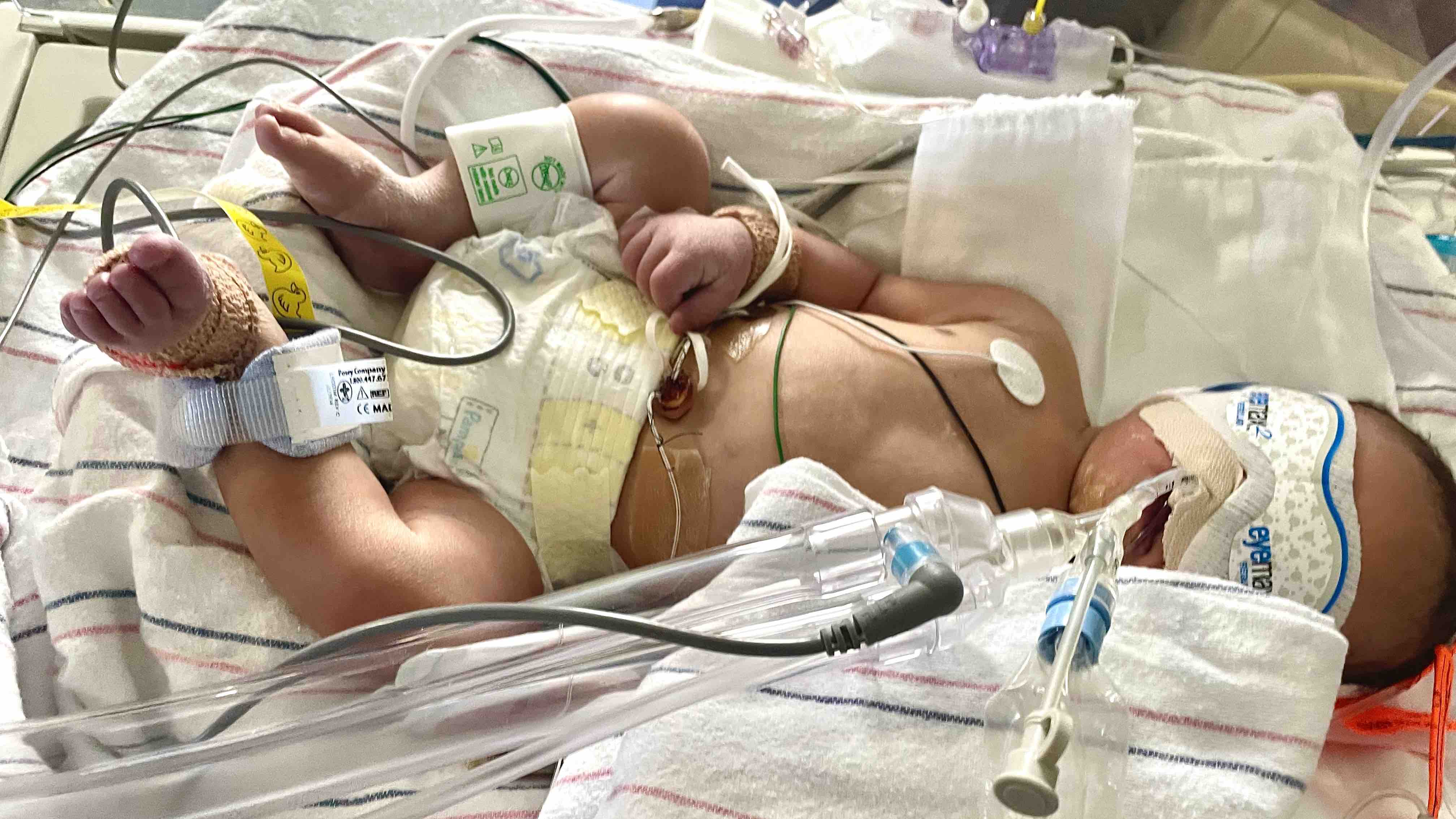 Fundraiser by Simone Champagne : Help baby Ezra