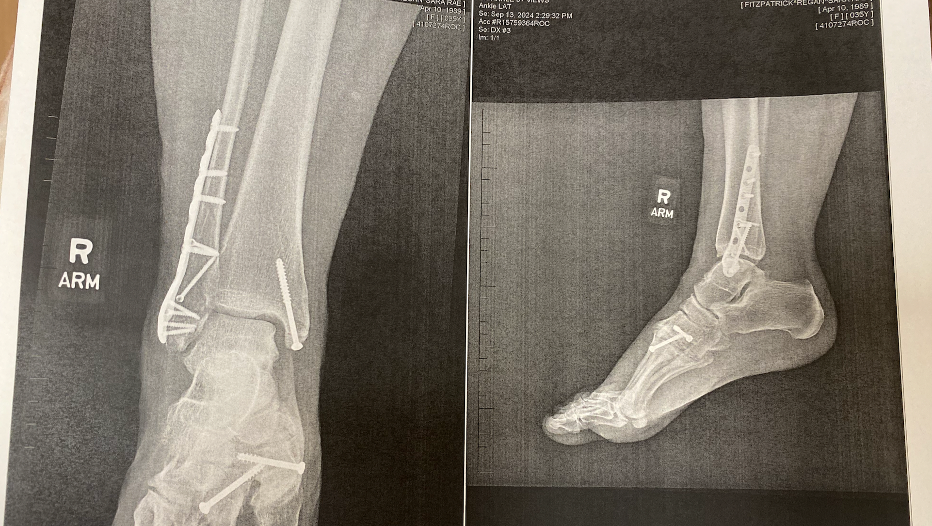 Fundraiser for Regan FitzPatrick by Kayla Breanna Alexander : Help ...