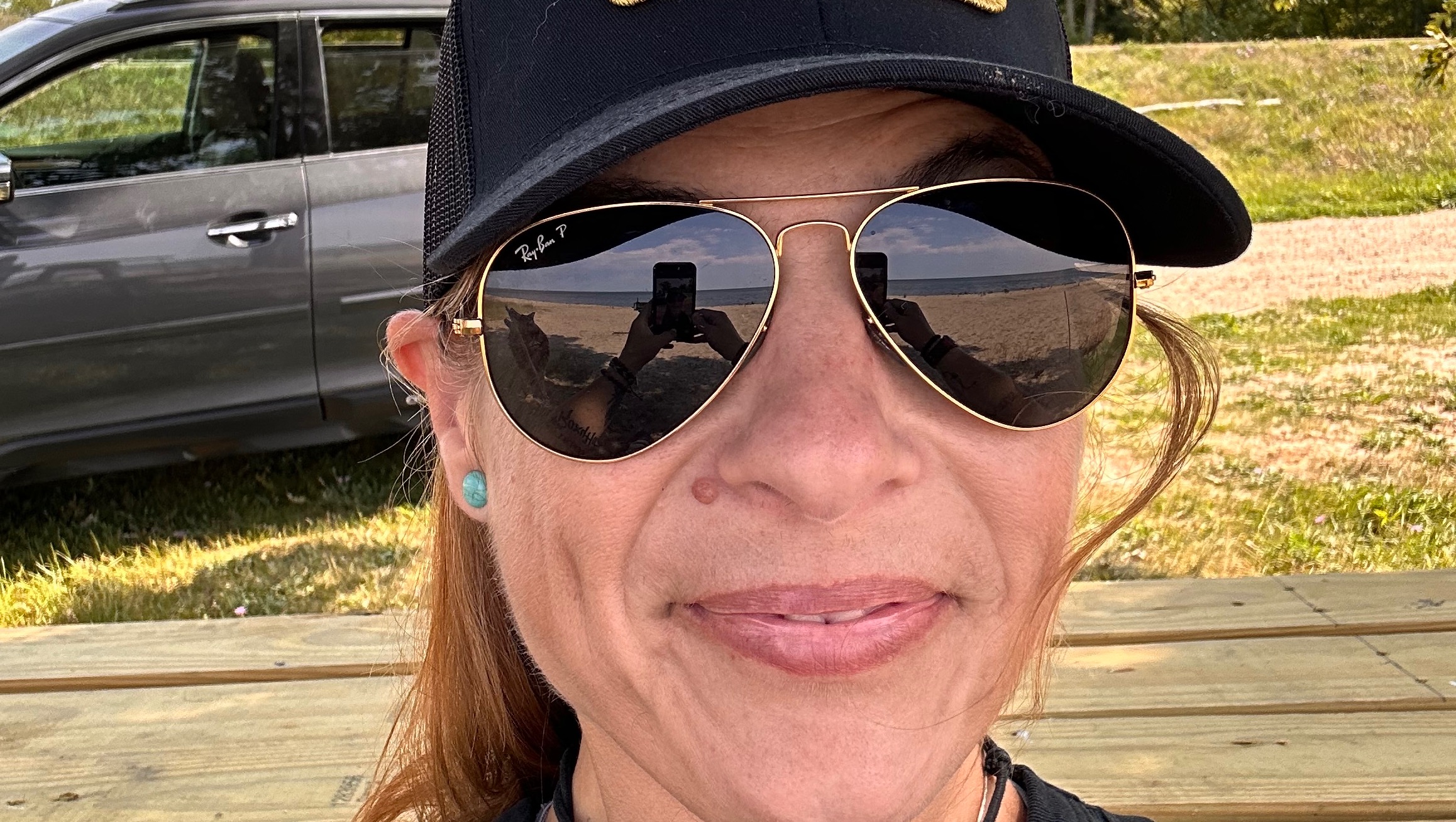 Fundraiser by Lisa Balzer : Help Cover Living Expenses During Surgery ...