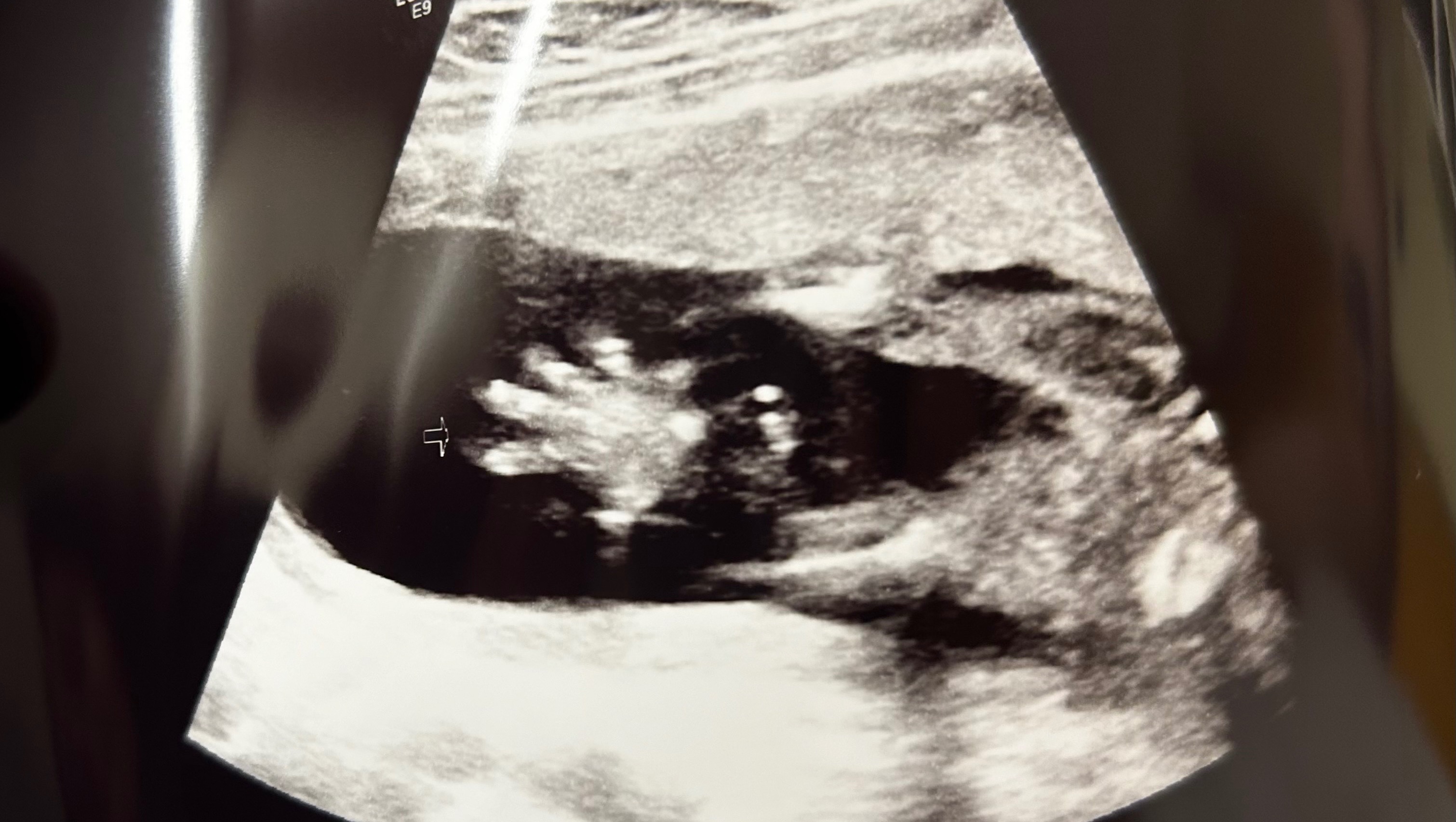 Fundraiser by Drew Michaud-Goetz : Help Us Welcome Our Baby Boy!