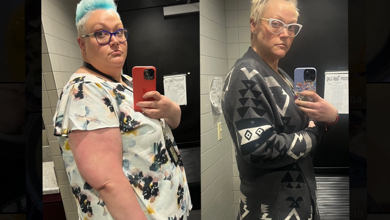 Fundraiser by Jaime Worden : Jaime's Post-Weight-Loss Skin Surgery
