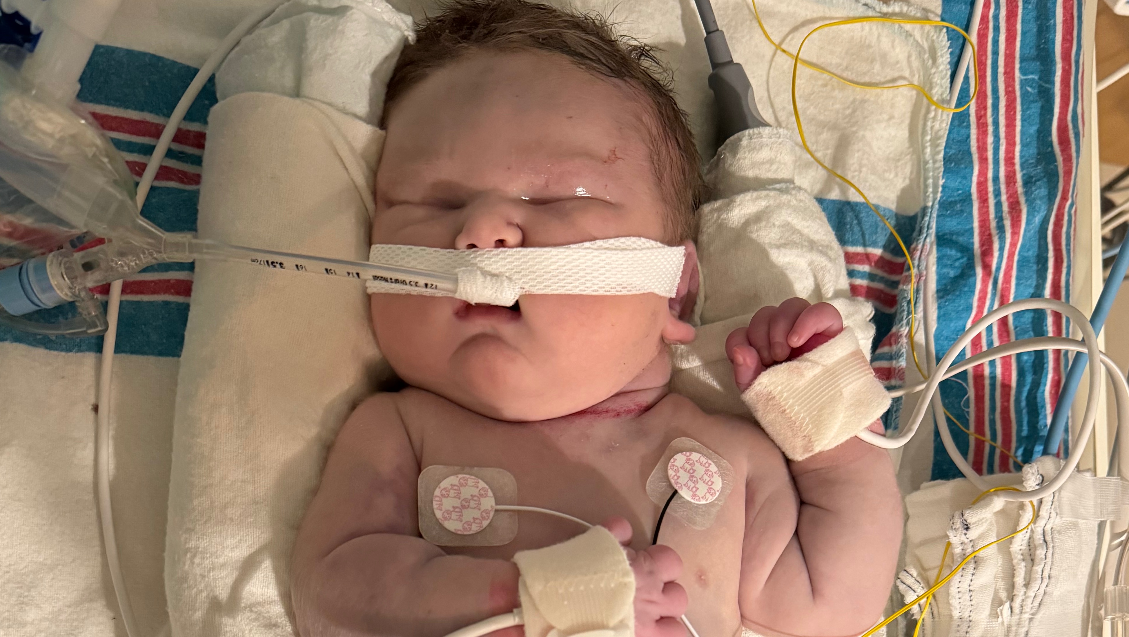 Fundraiser by Kristin Foster : Prayers and Support for Baby Dawson