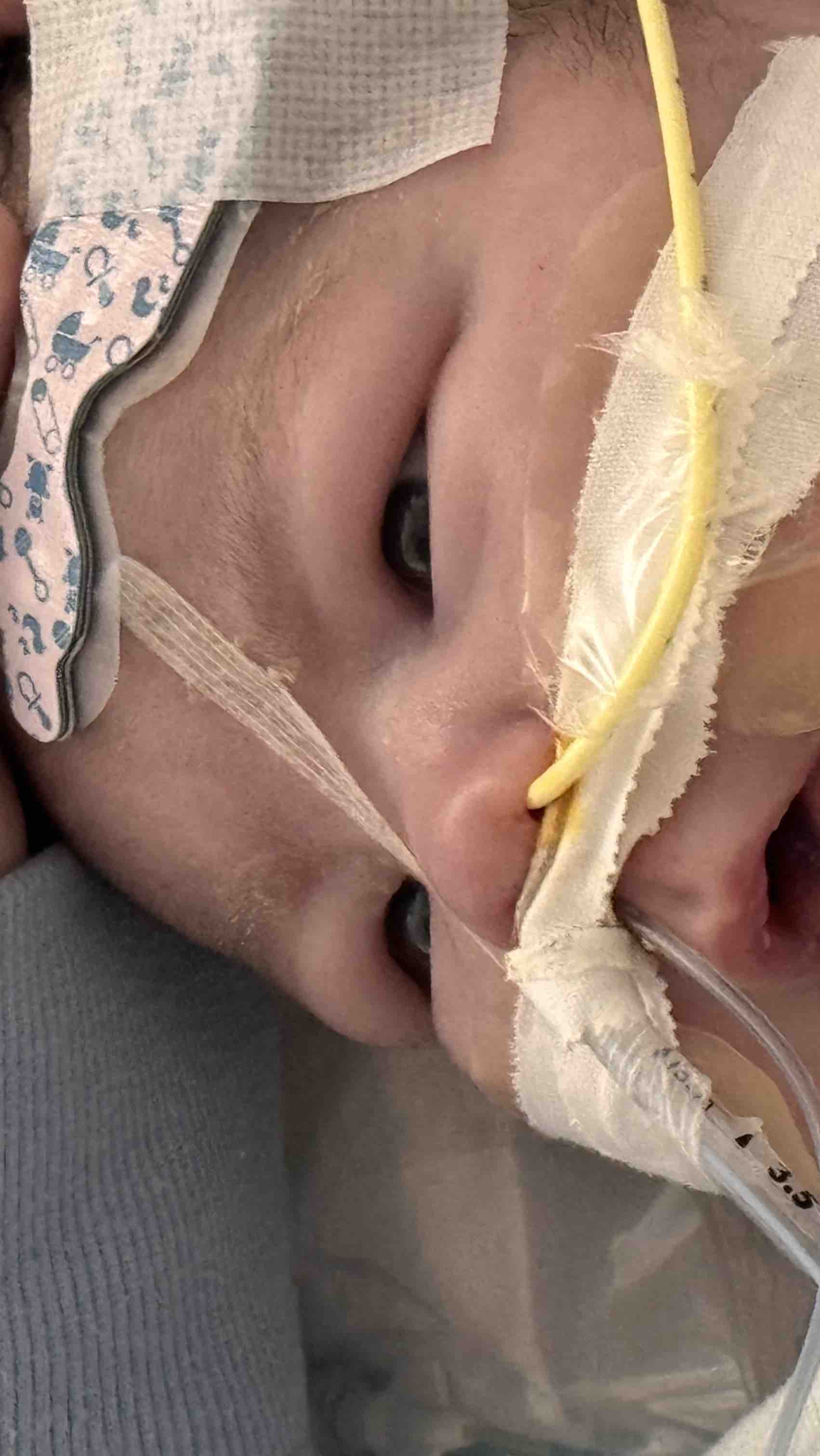 Fundraiser by Julie Weekley : Sophia's Flutterby Heart Fund