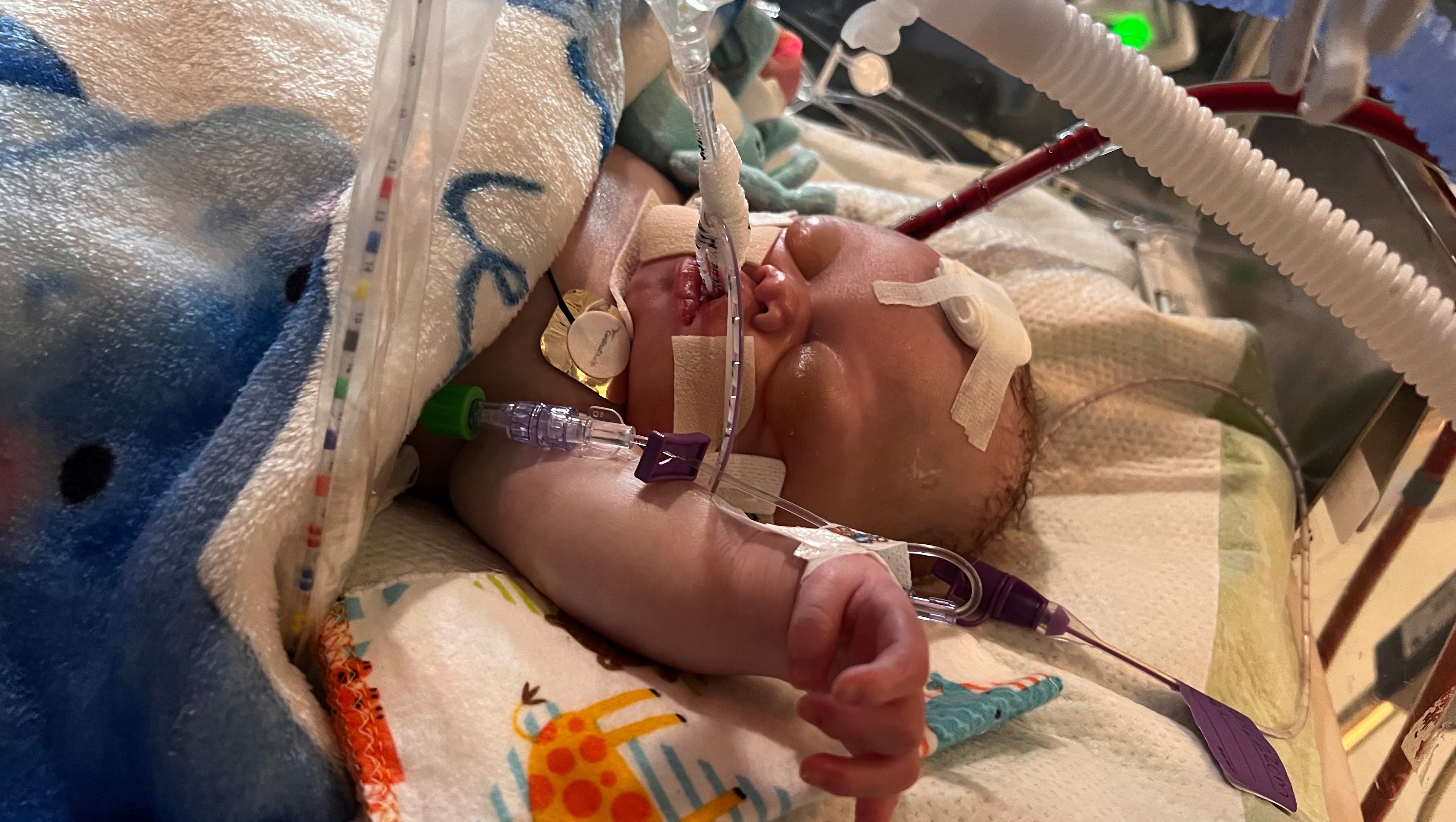 Fundraiser by Hannah Stevens : Help Carson's Family Stay by His Side