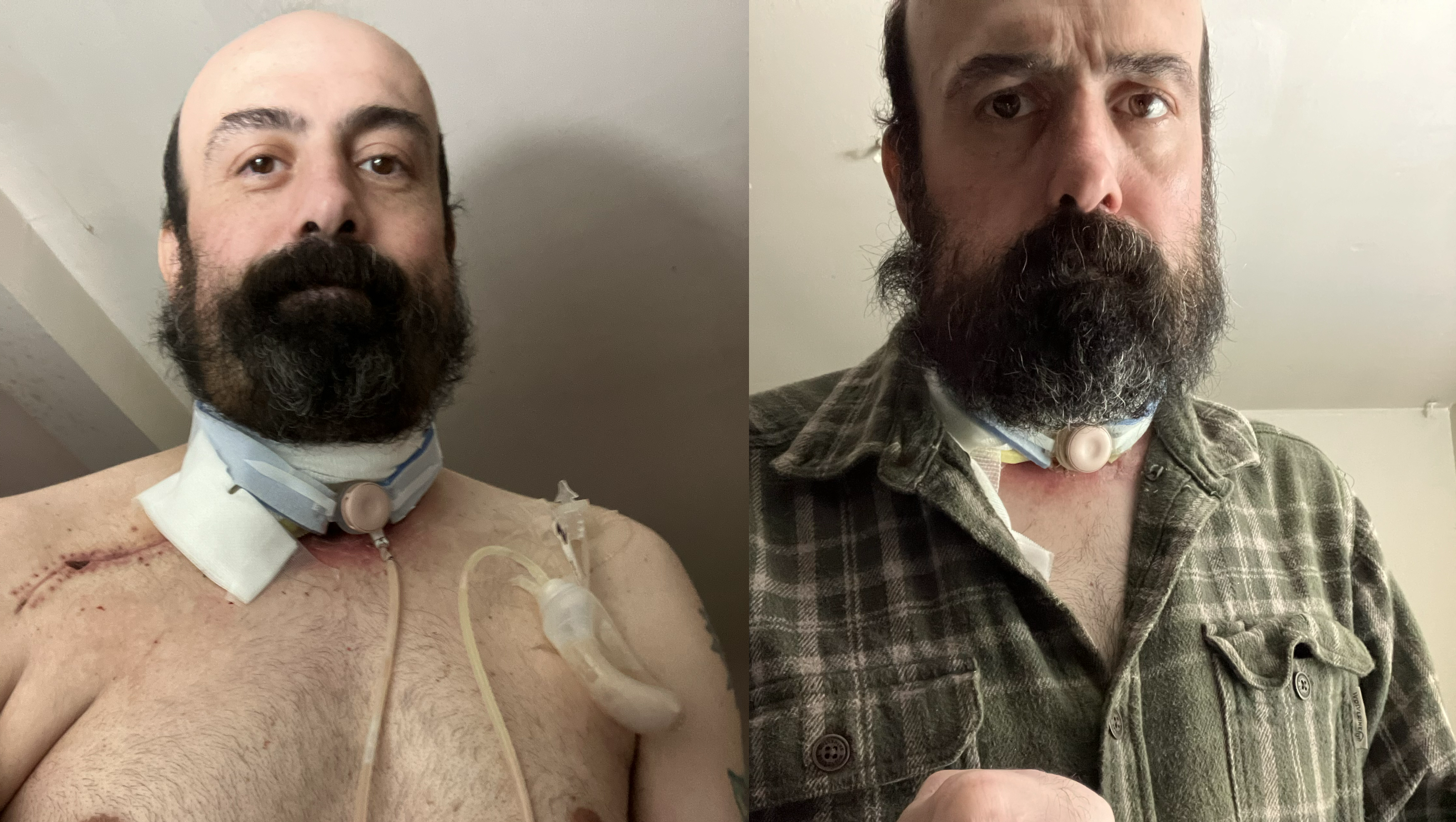 Fundraiser for Chris Lukens by Michael Burke : Help Chris Lukens Fight ...