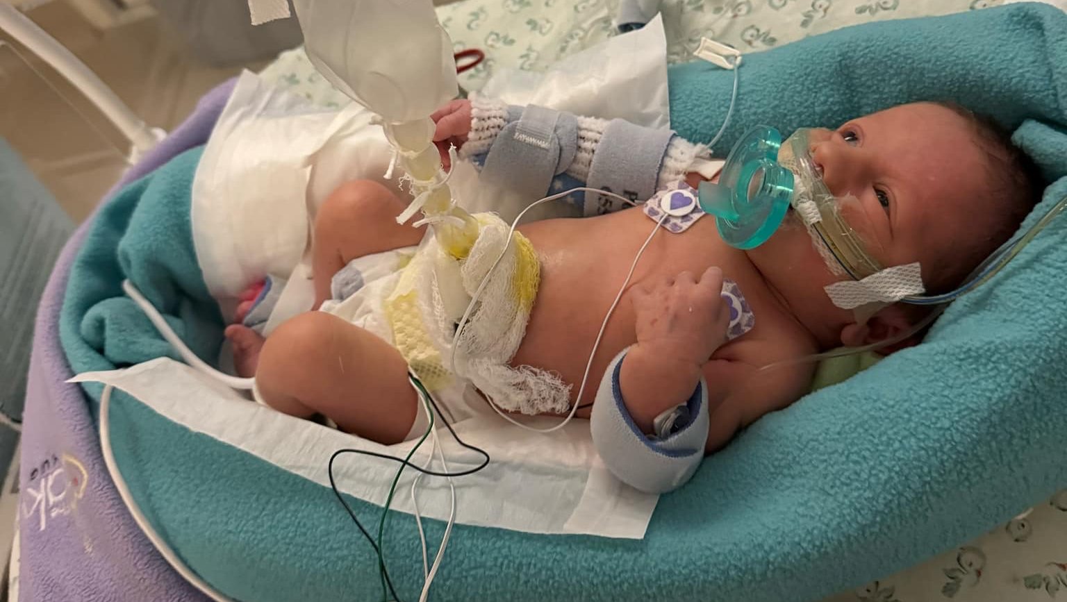Fundraiser for Mikayla Kerkove by Shelby Cranston : Help Baby Caroline ...