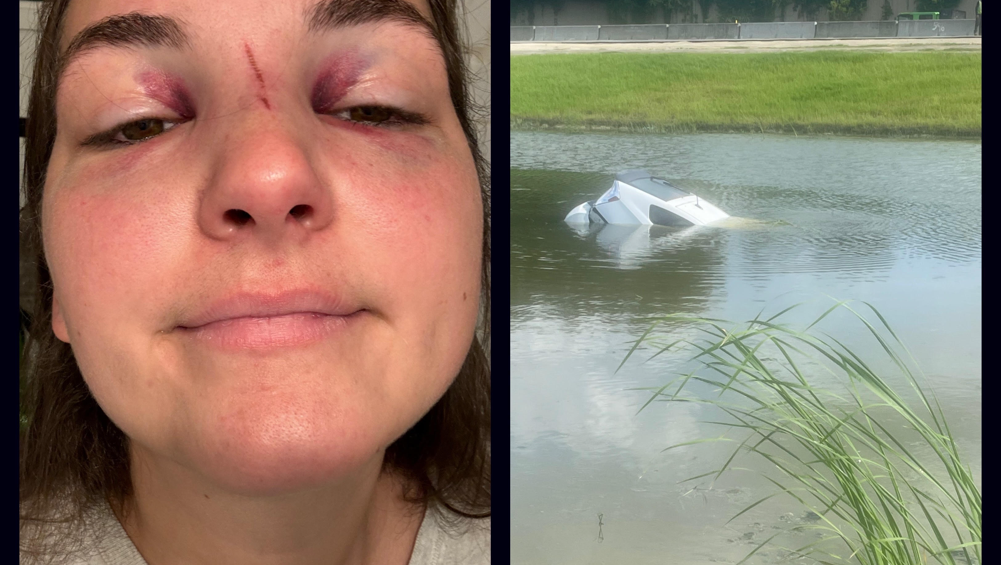 Fundraiser by Anna Lester : Help Anna Recover From Car Accident