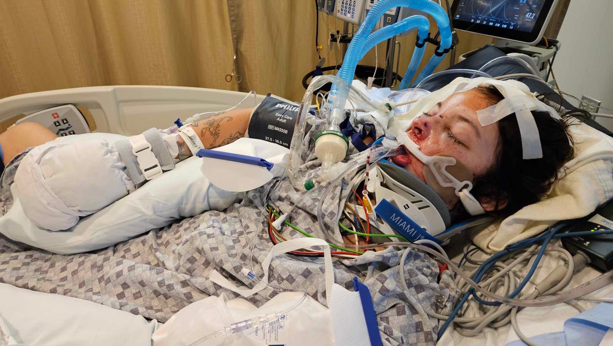 Fundraiser for Haylee Knapp by Kiera Turner : Donate to help fund ...