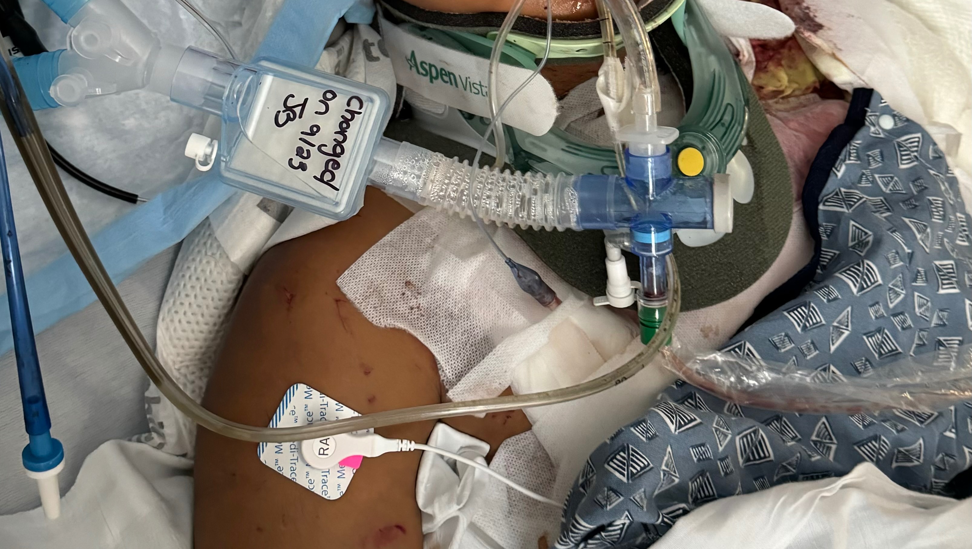 Fundraiser for Jennifer Cepeda-Collado by Nohely Rose : Support Alianny ...