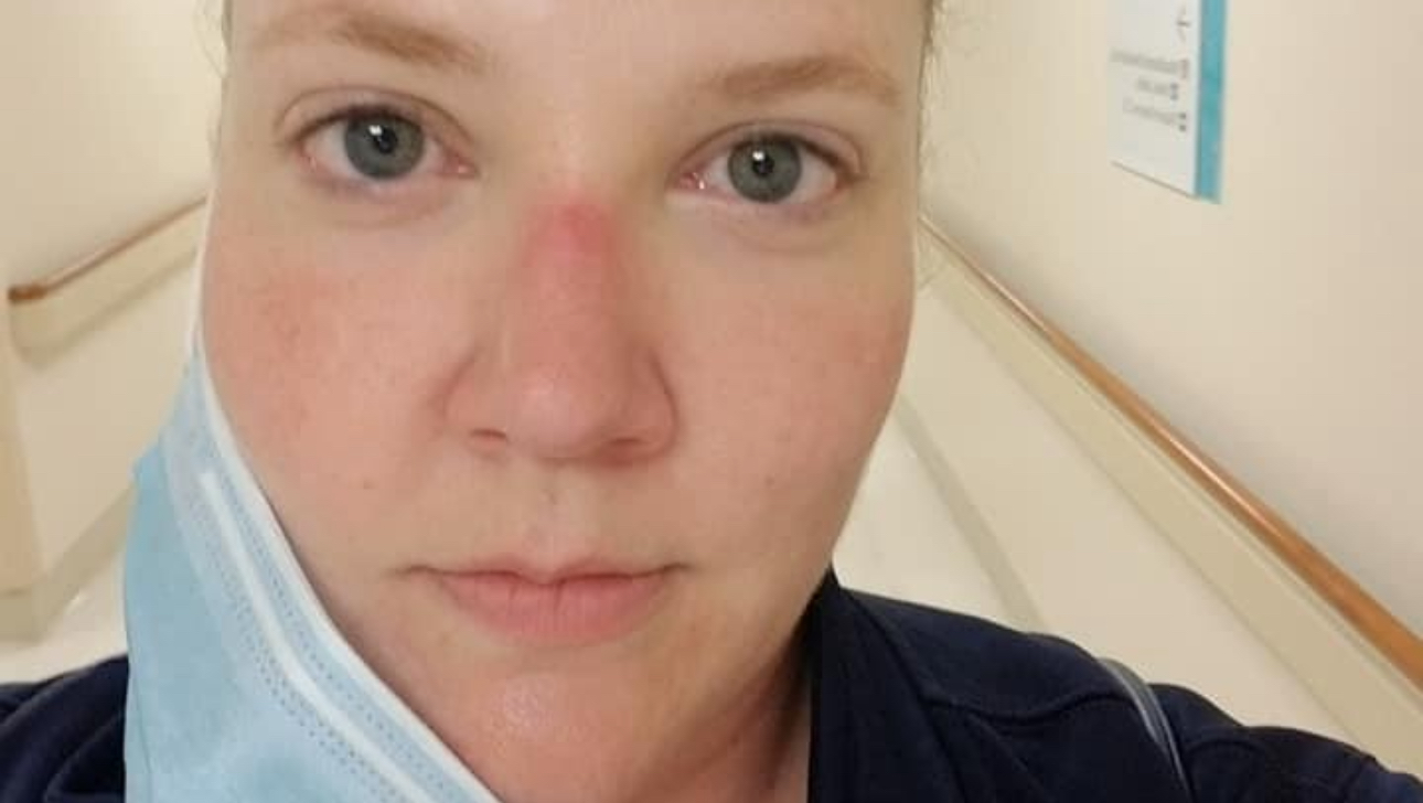 Fundraiser for Jessica Hayes by Annie Williams : Support ER Nurse ...
